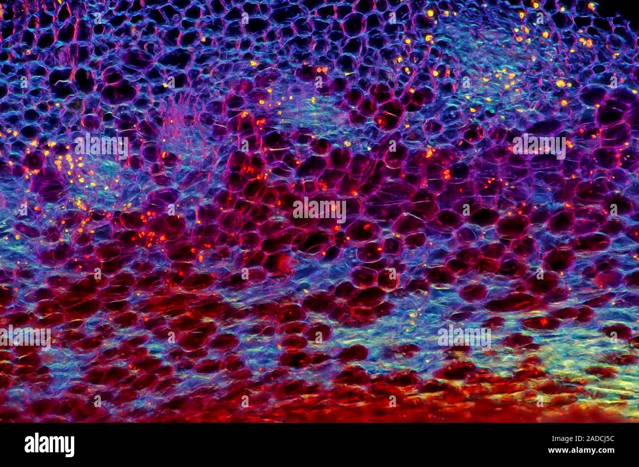 Beetroot (Beta vulgaris) tissue. Darkfield illuminated polarised light ...