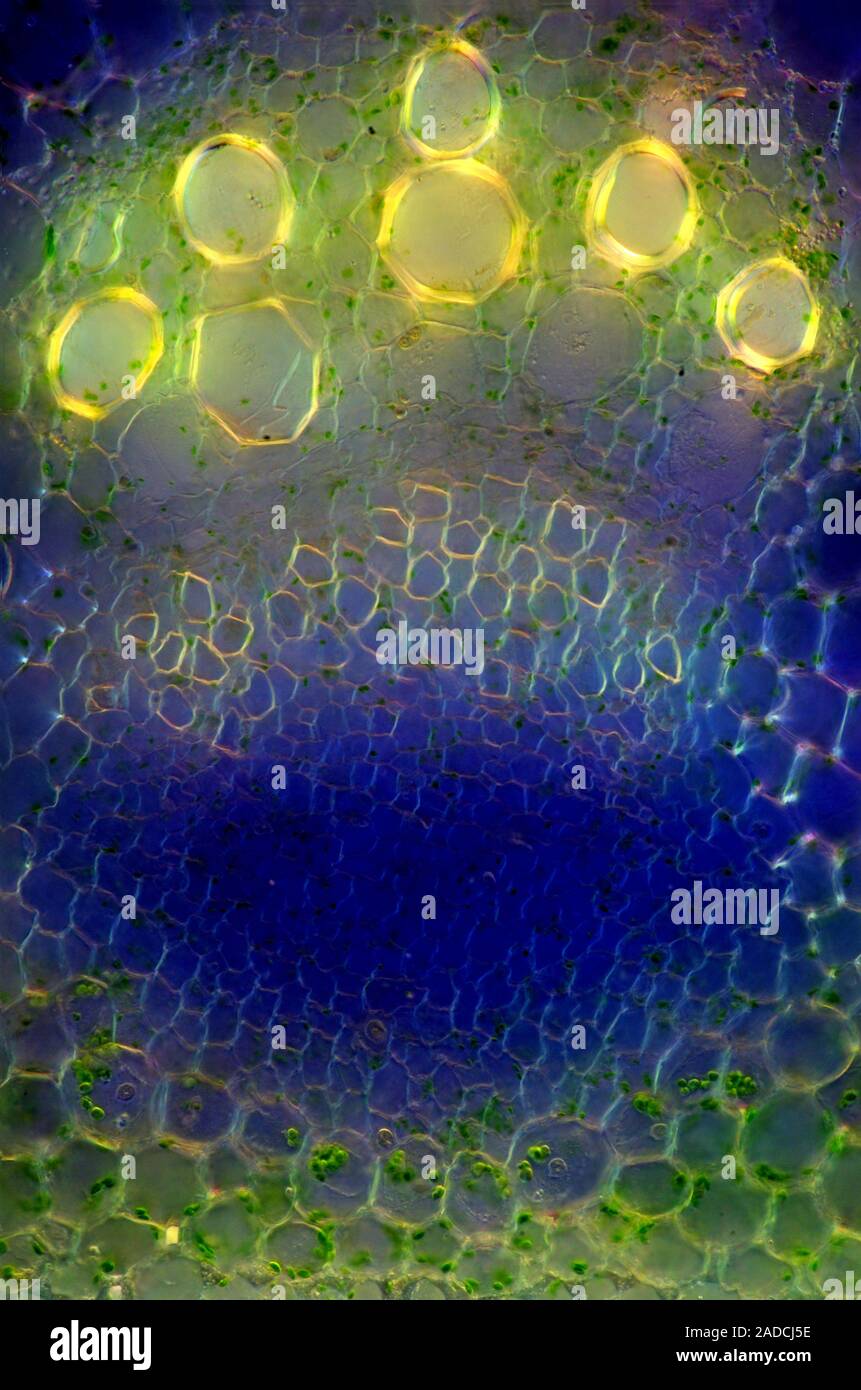 Dahlia sp. stalk. Darkfield illuminated polarised light micrograph of a ...