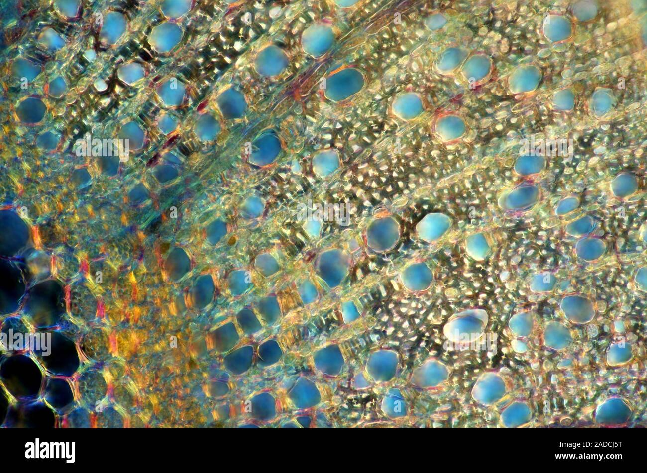 Apple (Malus pumilla) tree stalk. Darkfield illuminated polarised light ...
