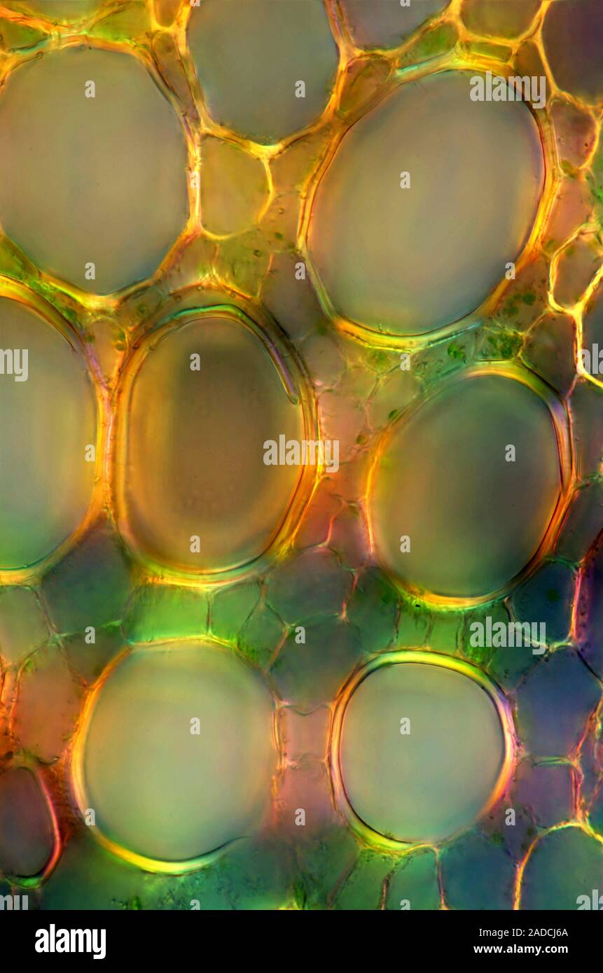 Lily (Lilium sp.) stalk. Polarised light micrograph of a transverse ...