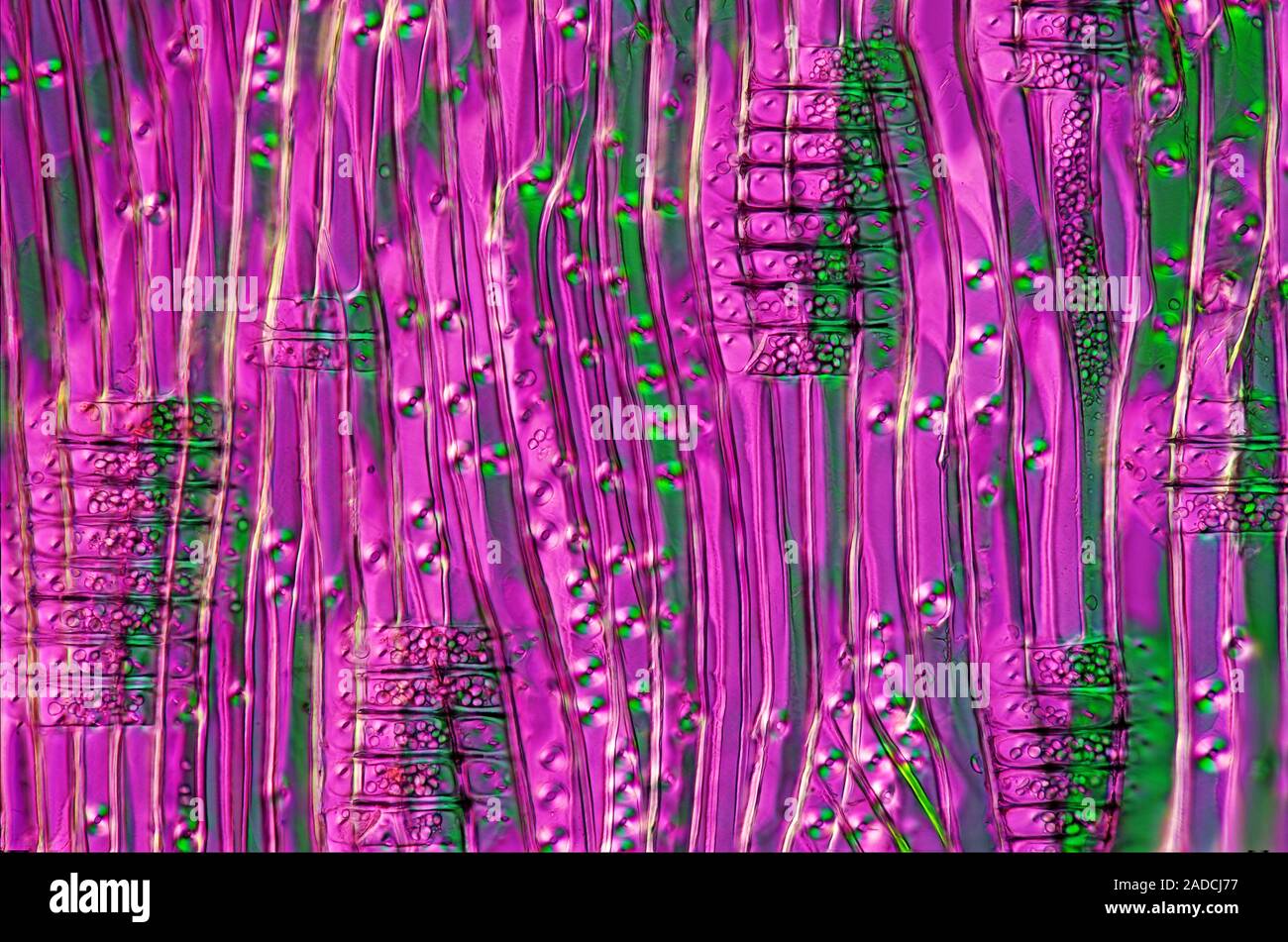 Cypress (family Cupressaceae) tree stalk. Polarised light micrograph of ...