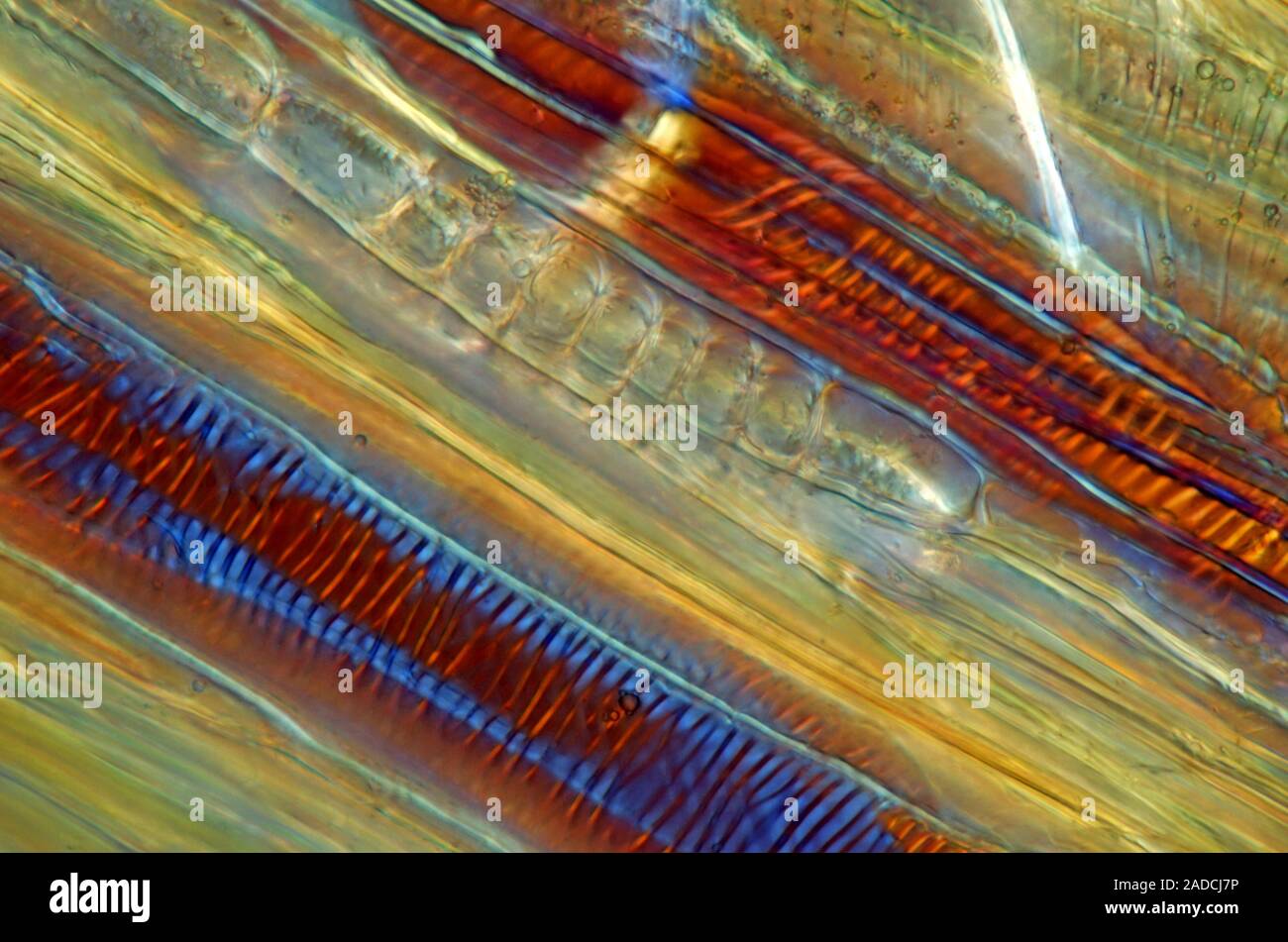 Cypress (family Cupressaceae) tree stalk. Polarised light micrograph of ...