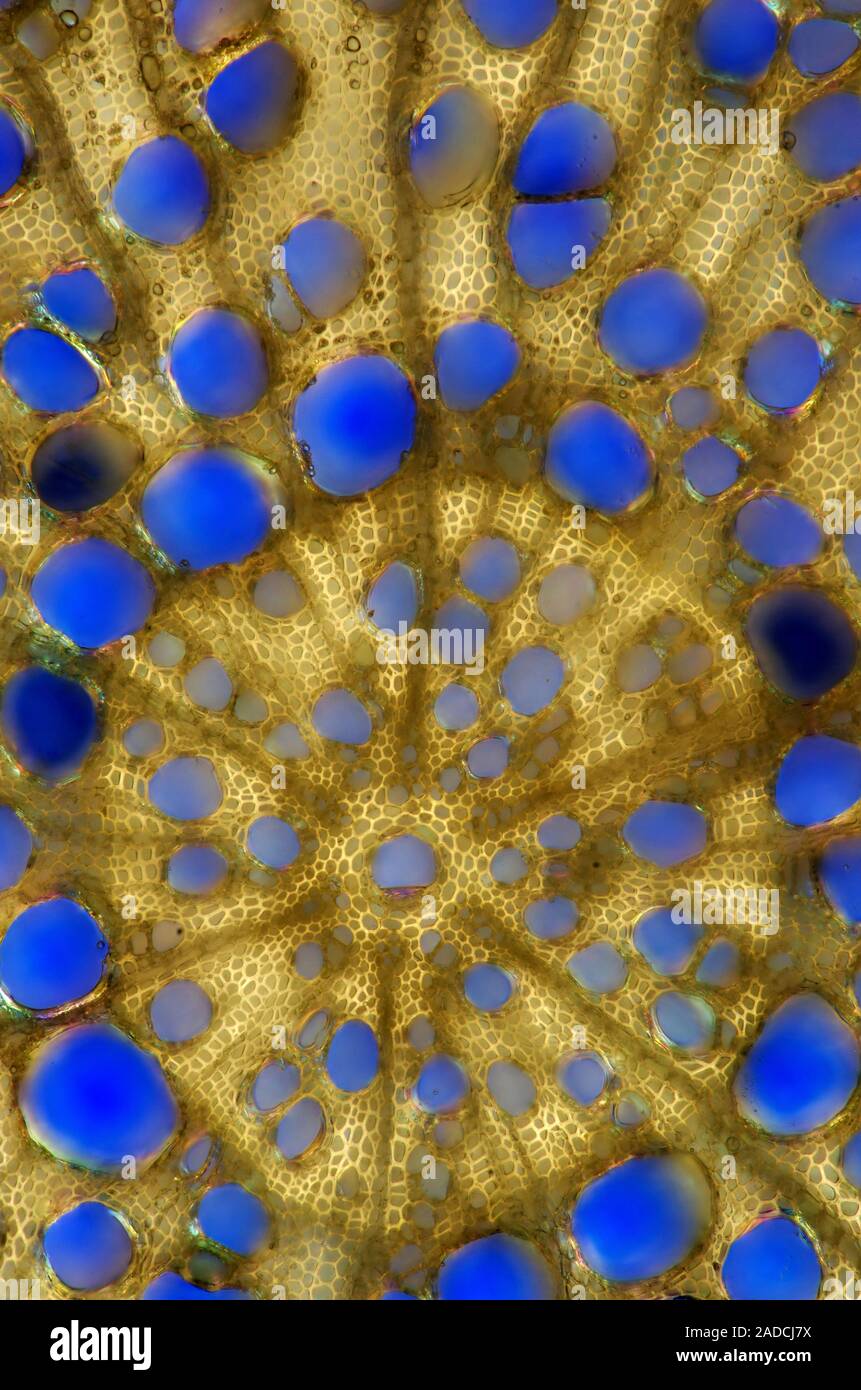 Sumac Rhus Sp Sprout Tissue Polarised Light Micrograph Of A Transverse Section Through The