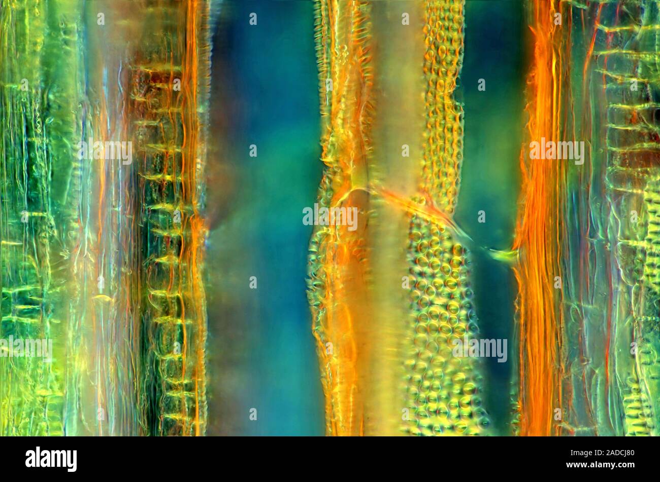 Cypress (family Cupressaceae) tree stalk. Darkfield illuminated ...