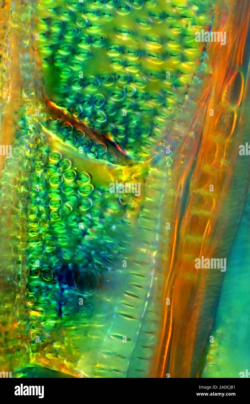 Cypress (family Cupressaceae) tree stalk. Darkfield illuminated ...