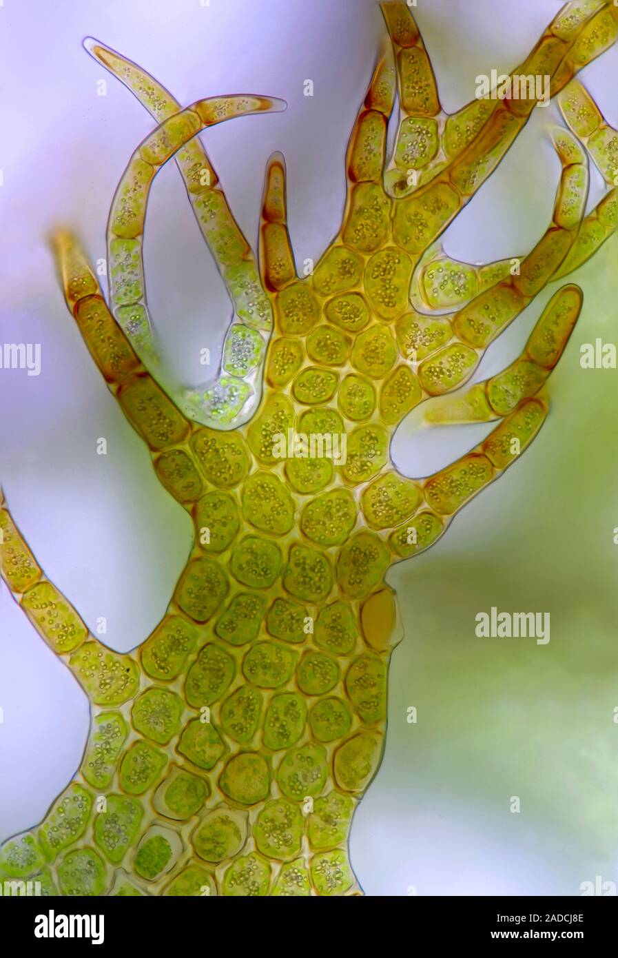 Marchantiophyte plant, polarised light micrograph. Magnification: x200 ...