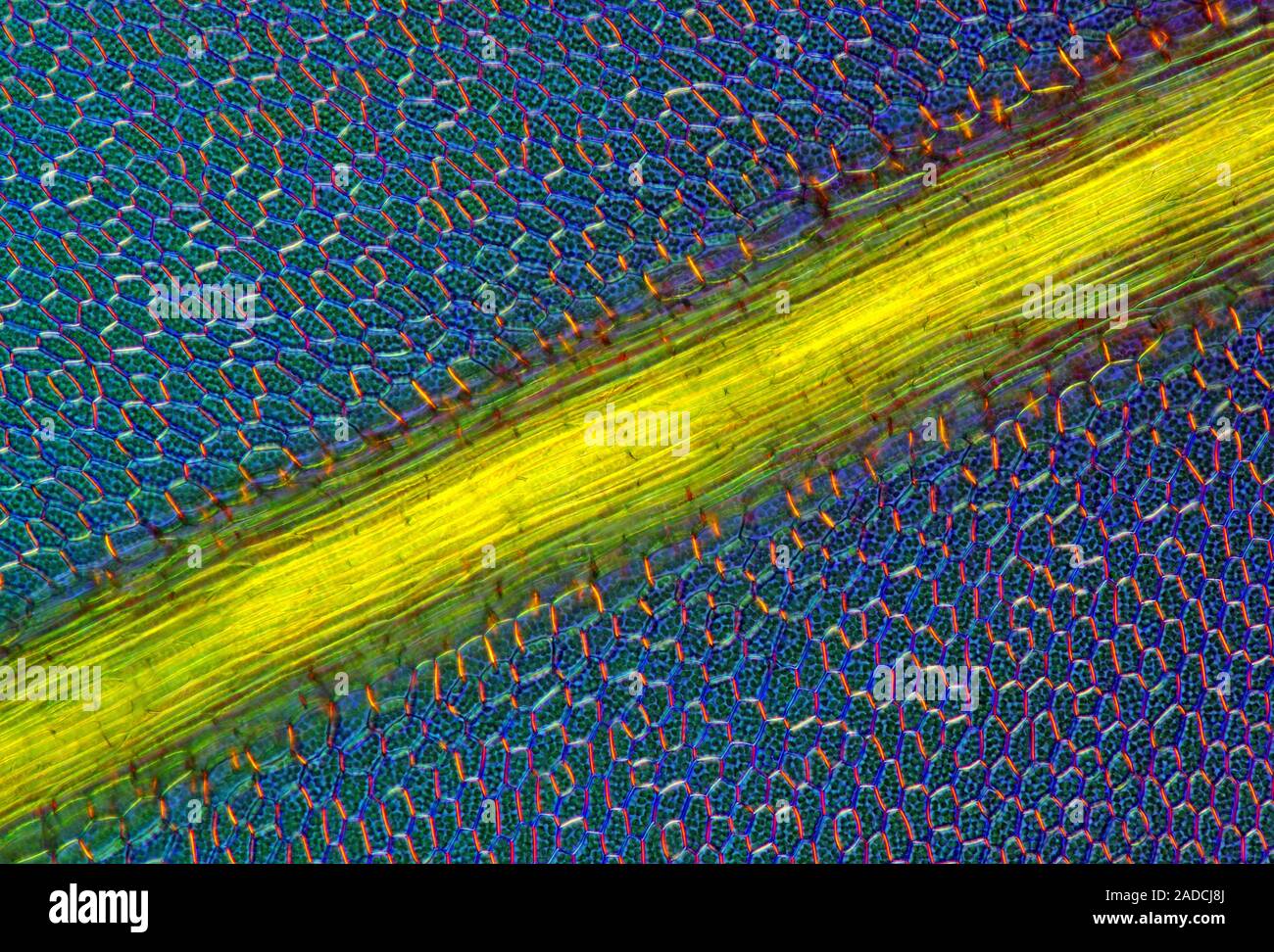 Moss leaf. Polarised light micrograph of a moss leaf, showing the ...