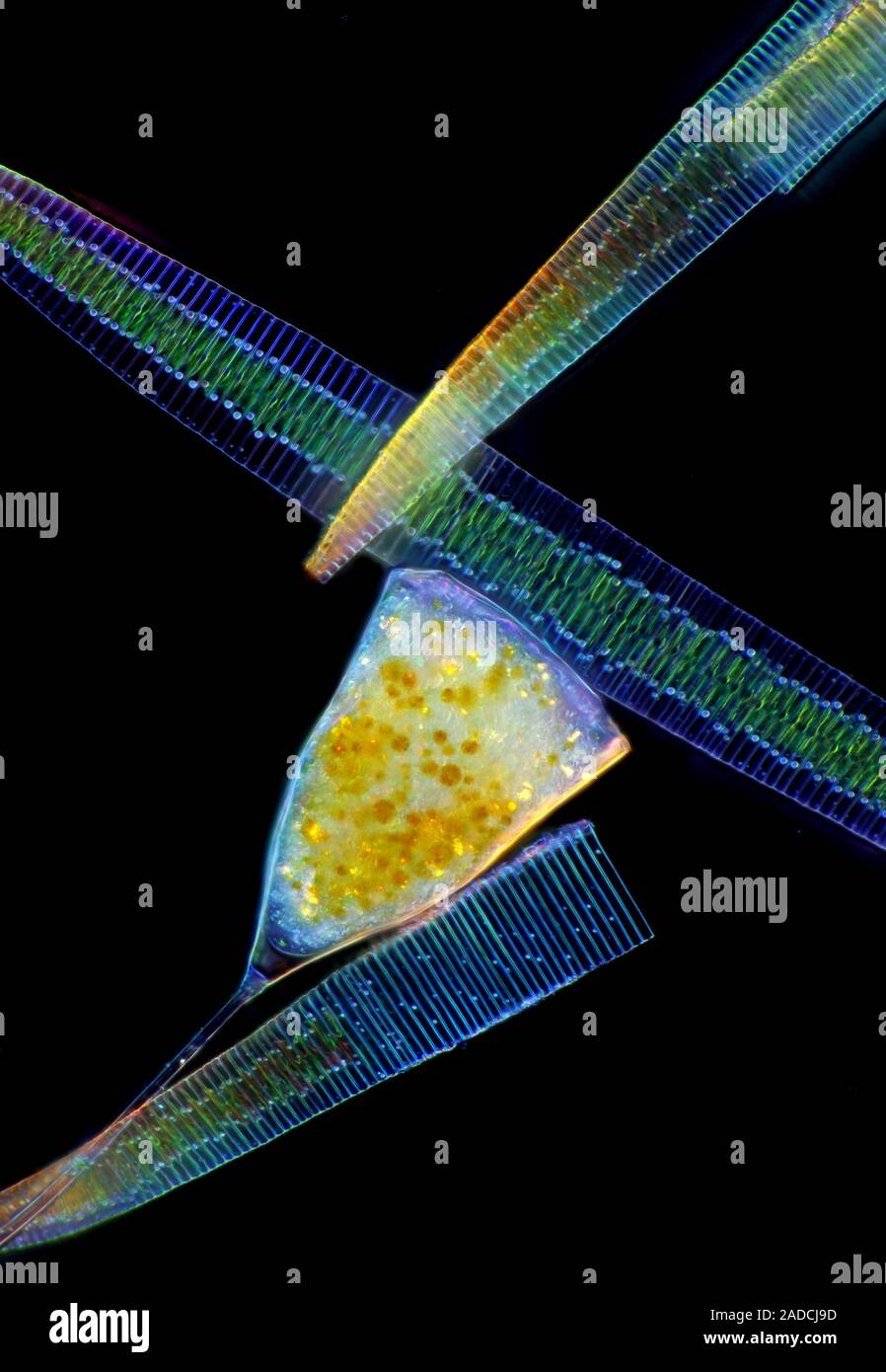 Suctorian protozoan and fragilaria diatoms. Darkfield illuminated ...