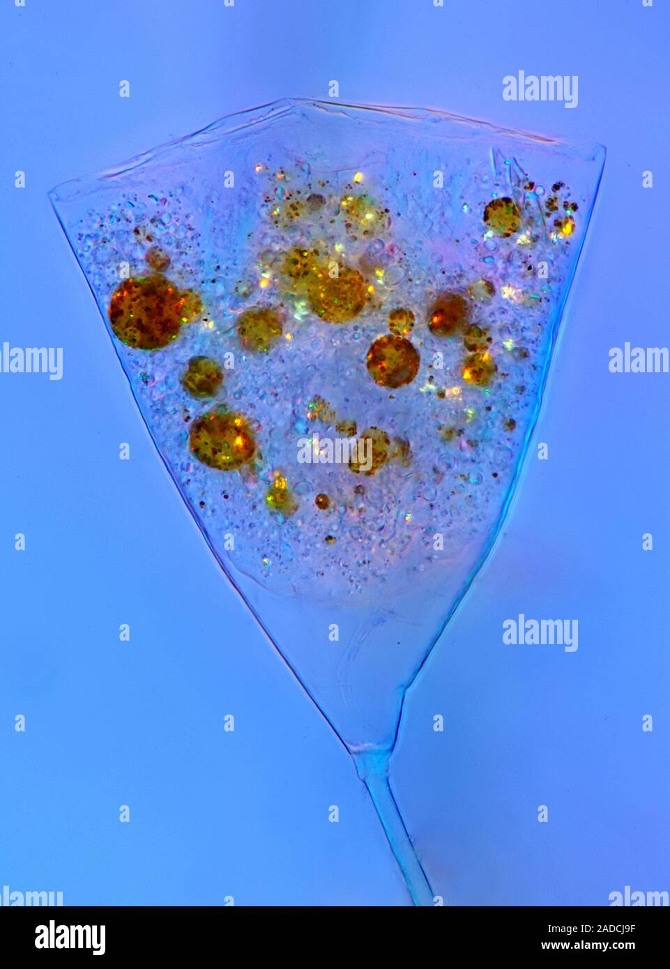 Suctorian protozoan. Darkfield illuminated polarised light micrograph ...