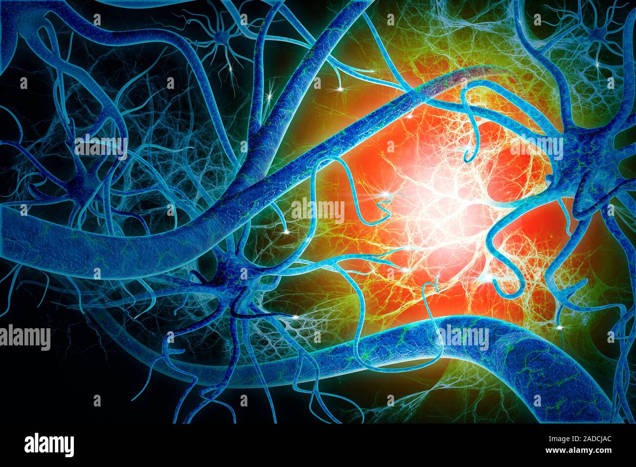 Brain injury. Conceptual illustration of nerve cells (neurons) forming ...