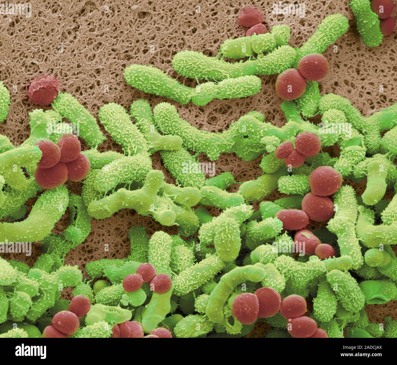 Athlete's foot fungus. Coloured scanning electron micrograph (SEM) of ...