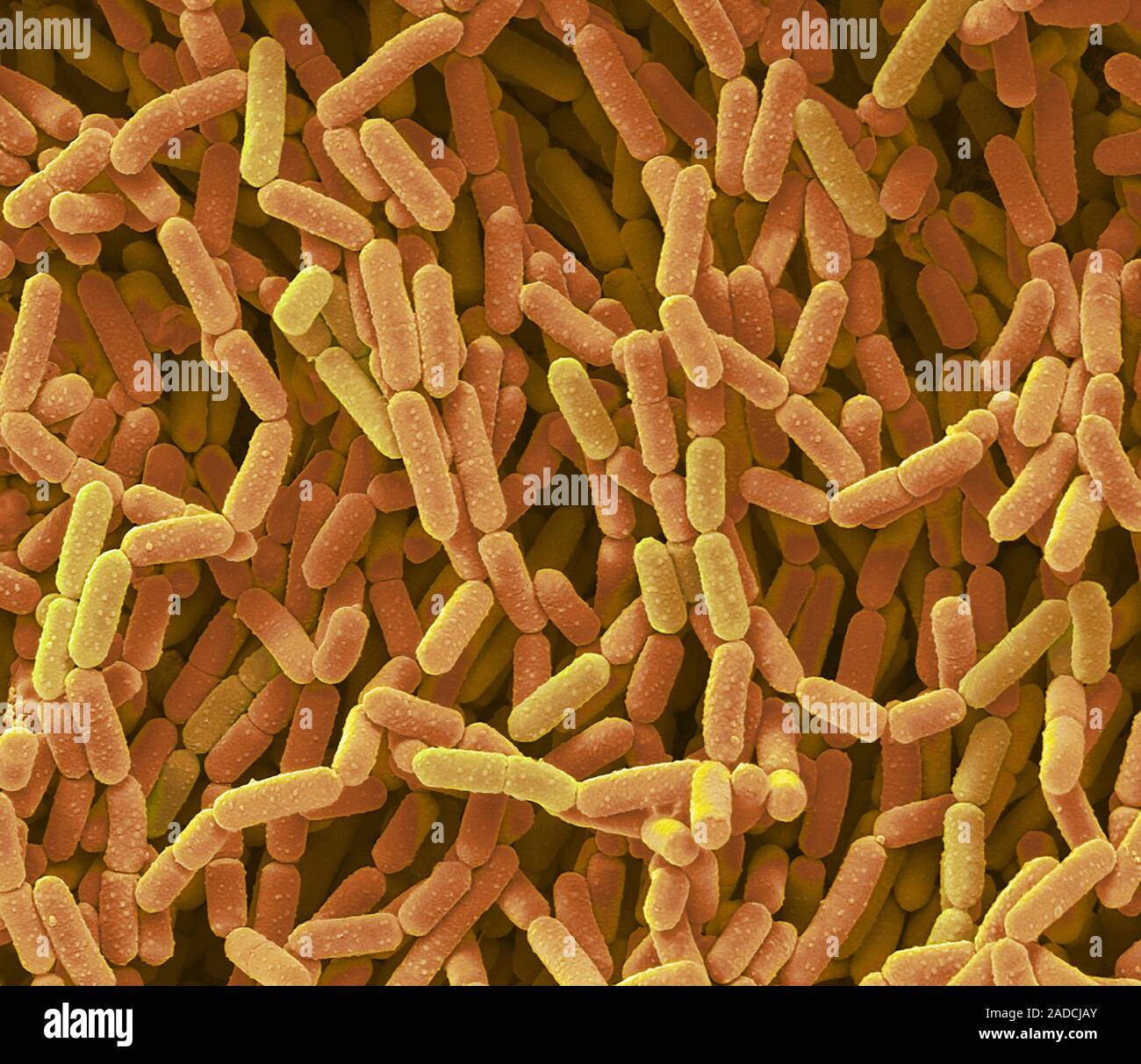 Lactobacillus rhamnosus bacteria, coloured scanning electron micrograph ...