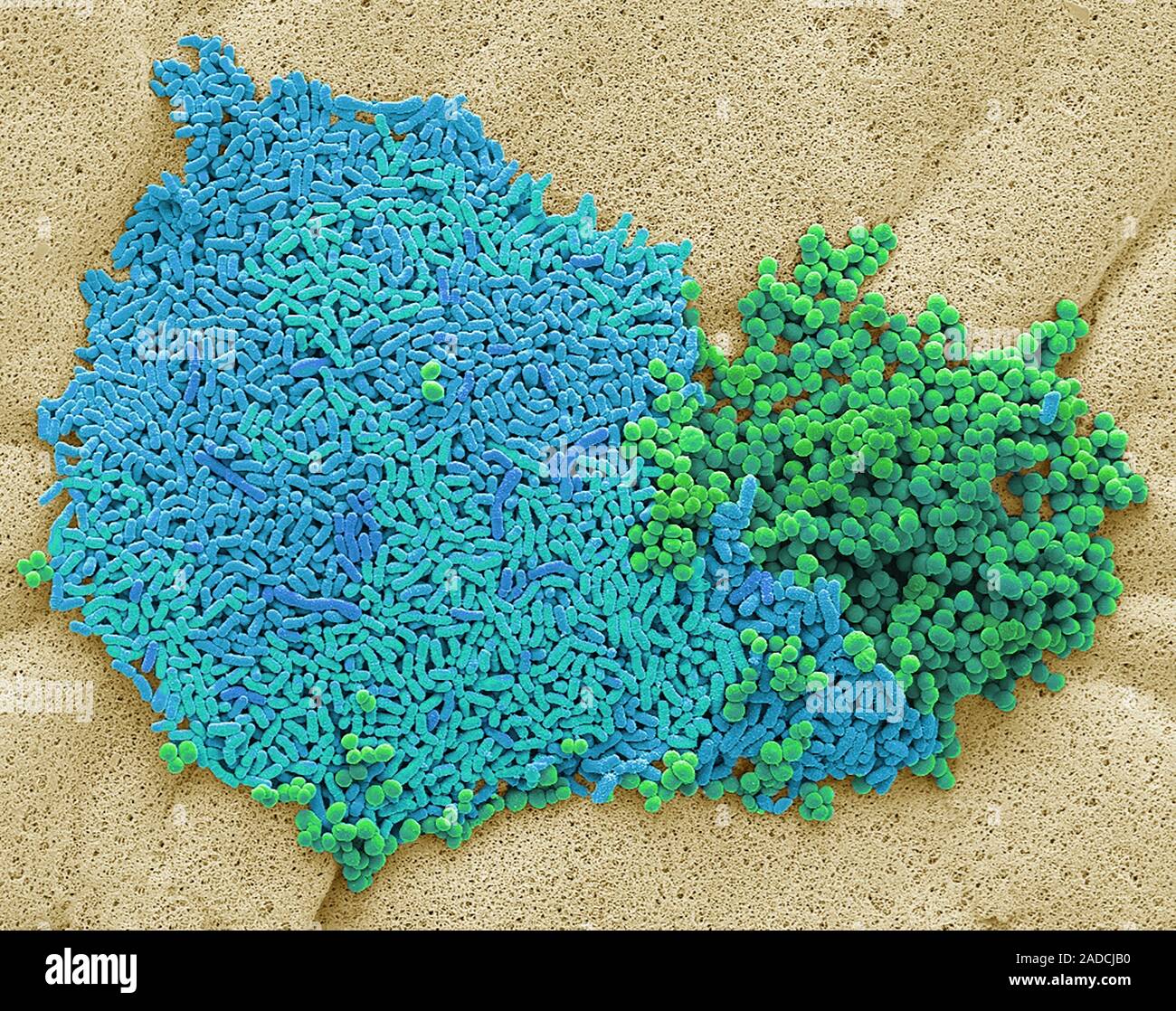 Foot bacteria. Scanning electron micrograph (SEM) of bacteria that live ...