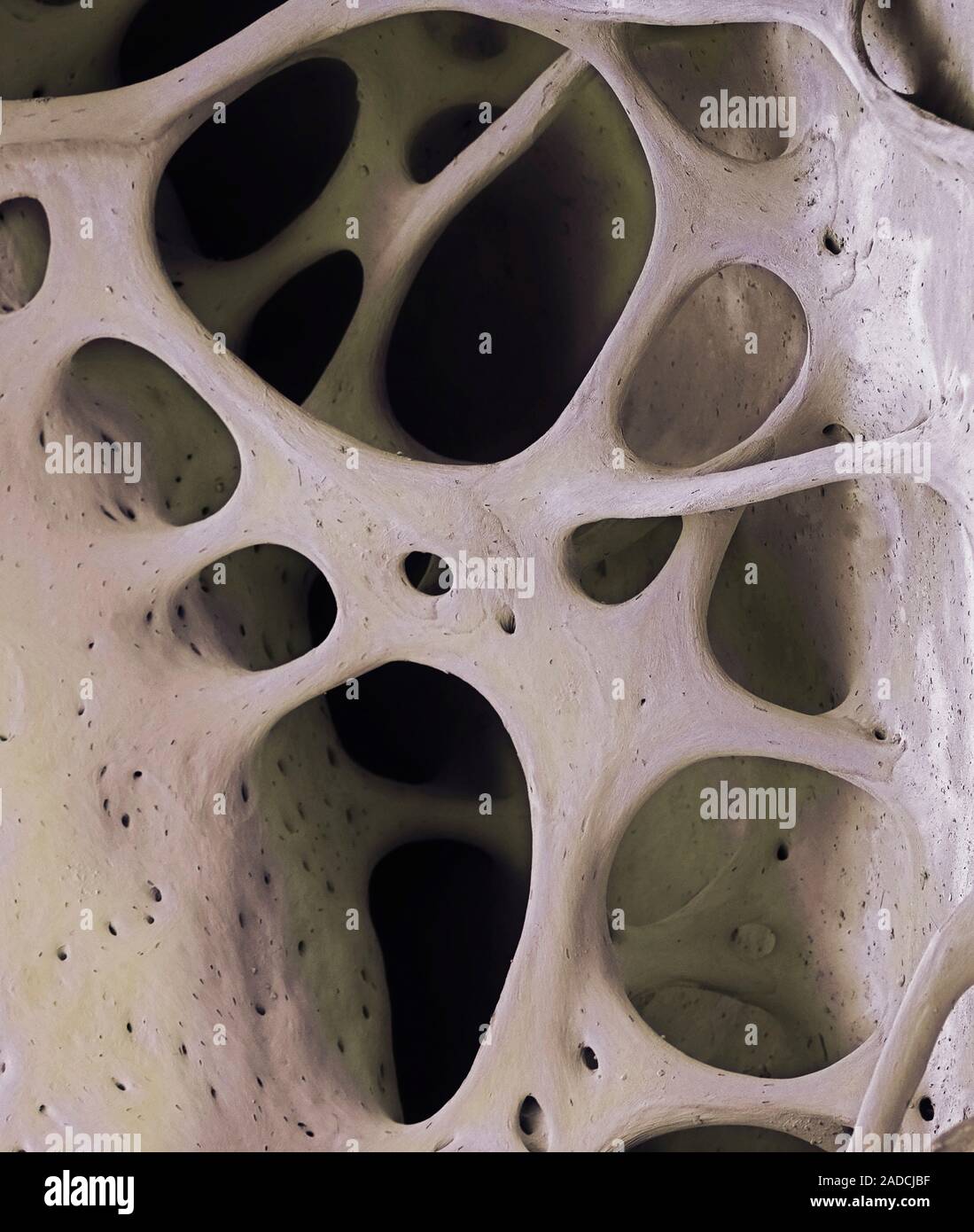 Bird bone tissue. Coloured scanning electron micrograph (SEM) of ...