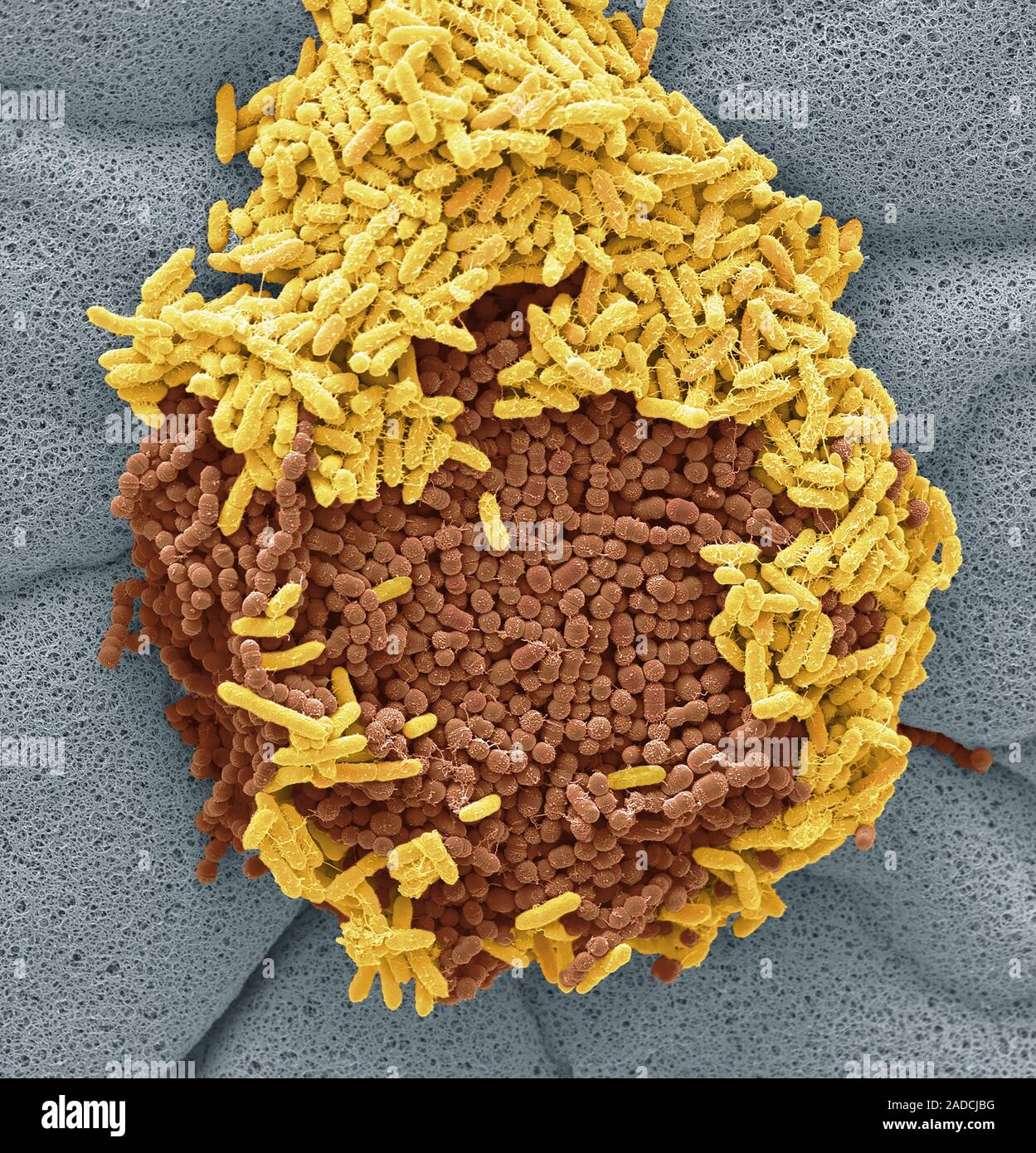 Faecal bacteria. Scanning electron micrograph (SEM) of bacteria ...