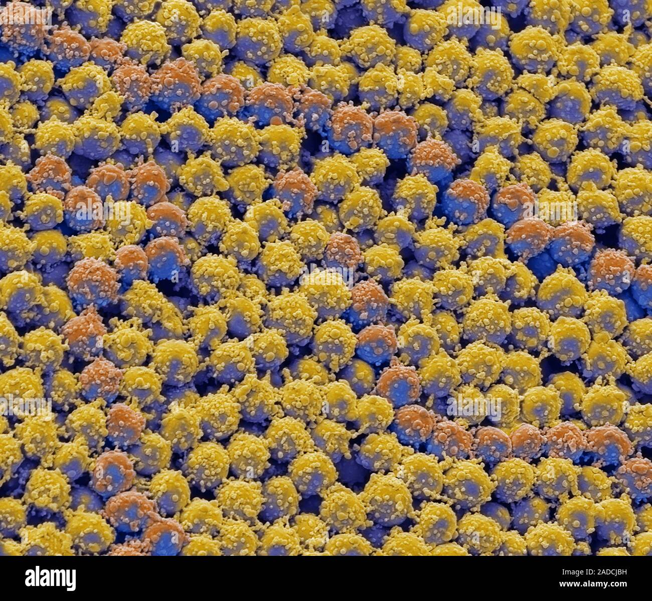 Lactococcus bacteria. Scanning electron micrograph (SEM) of Lactococcus ...