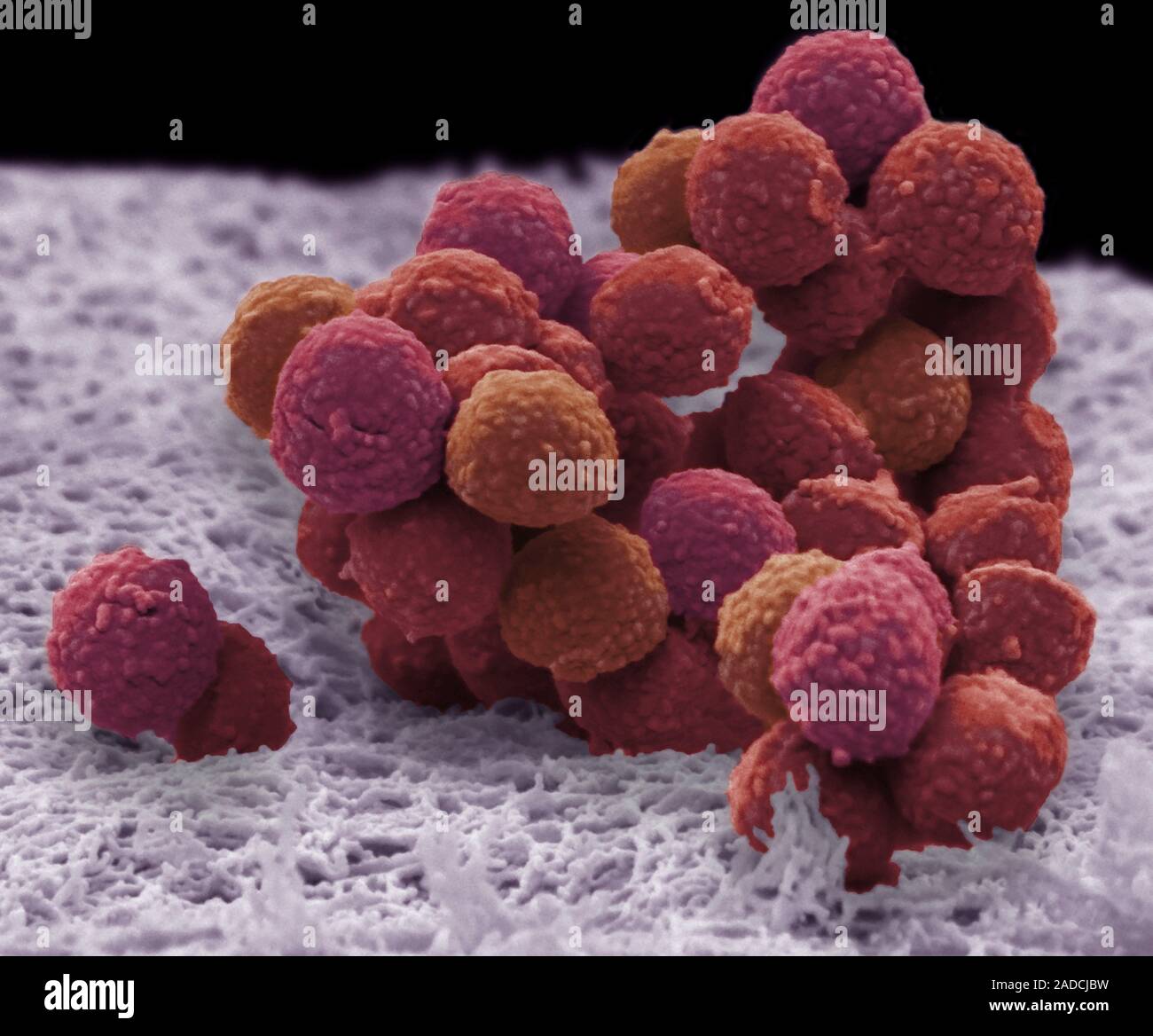 Staphylococcus epidermidis bacteria. Coloured scanning electron ... Staphylococcus epidermidis bacteria. Coloured scanning electron ...