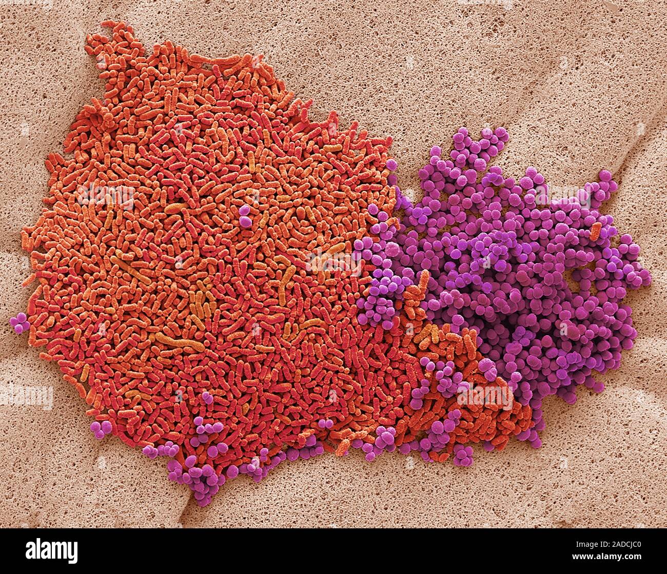 Foot bacteria. Scanning electron micrograph (SEM) of bacteria that live ...