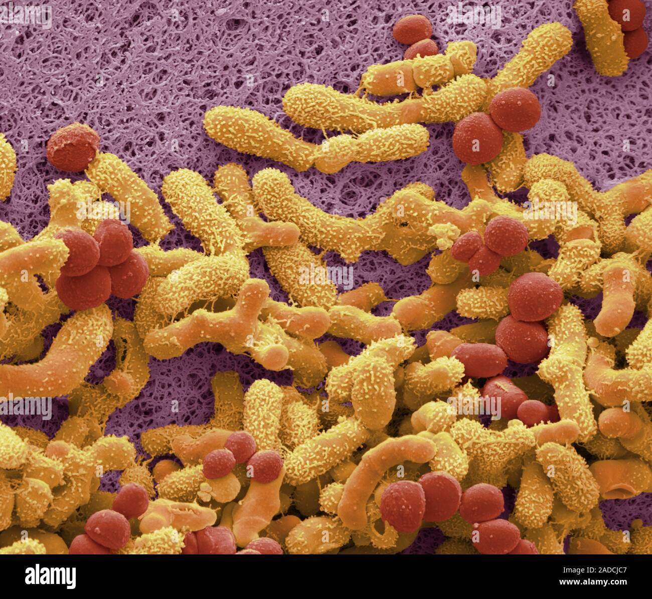 Athlete's foot fungus. Coloured scanning electron micrograph (SEM) of ...