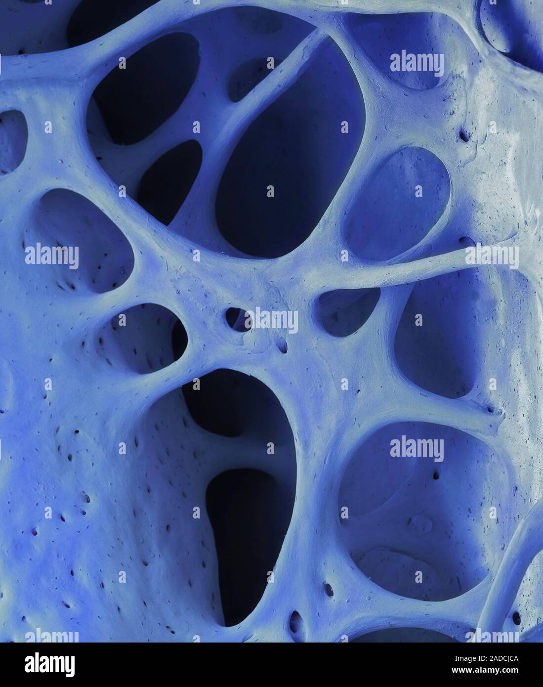 Bird bone tissue. Coloured scanning electron micrograph (SEM) of ...