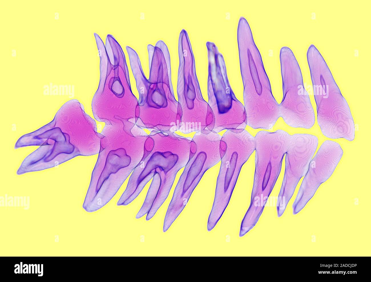 Human teeth. Coloured 3D lateral computed tomography (CT) scan of the ...