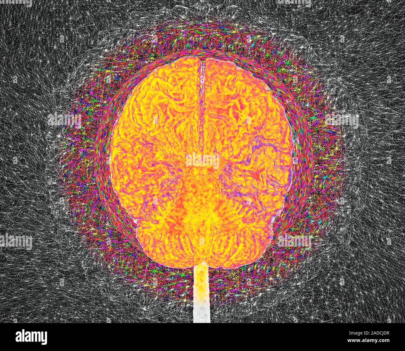 Human brain. Digitally enhanced 3D magnetic resonance imaging (MRI ...