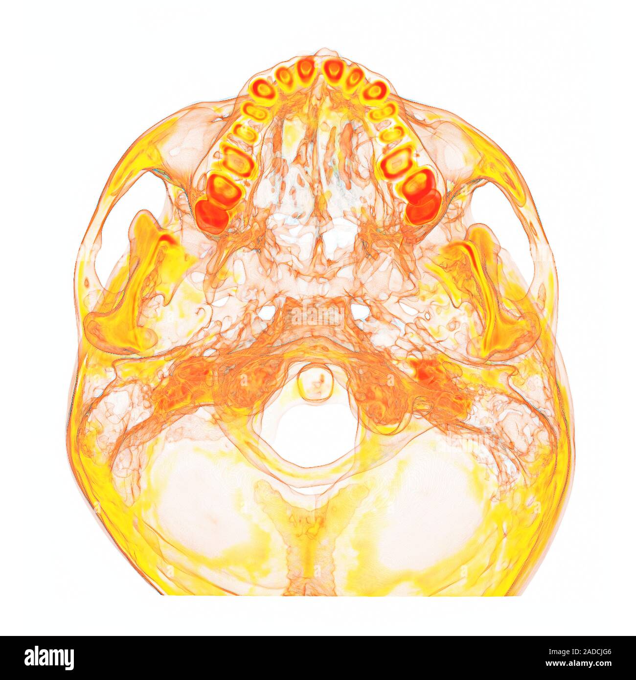Base of the skull. Coloured 3D computed tomography (CT) scan of the ...