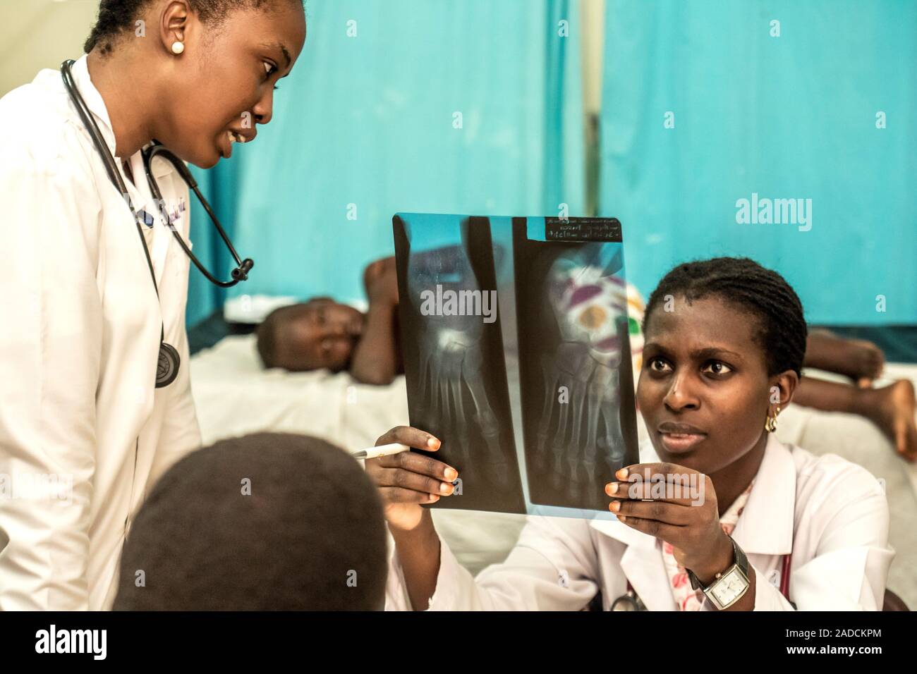Hospital doctors examining X-rays. The X-rays show the bones of the ...