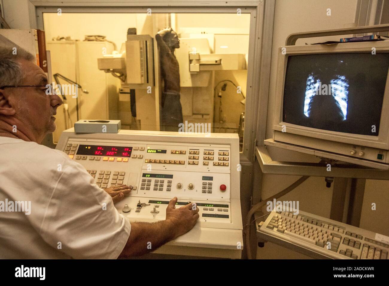 Radiographer carrying out an X-ray. The X-ray (upper right) shows the ...