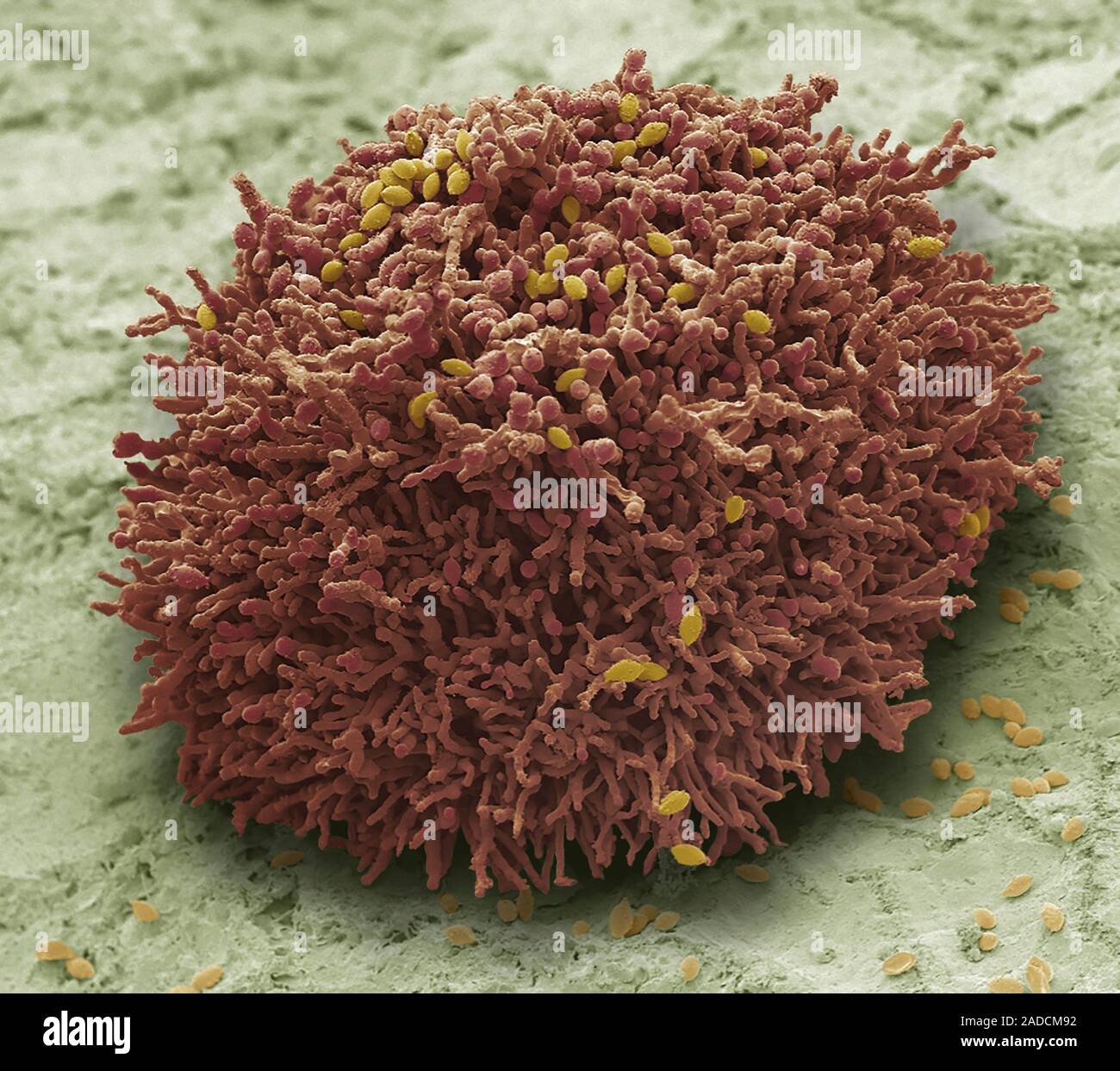 Mould colony. Coloured scanning electron micrograph (SEM) of fungi from ...