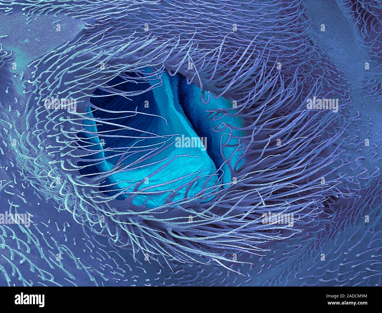 Fruit fly (Drosophila melanogaster) spiracle, coloured scanning ...