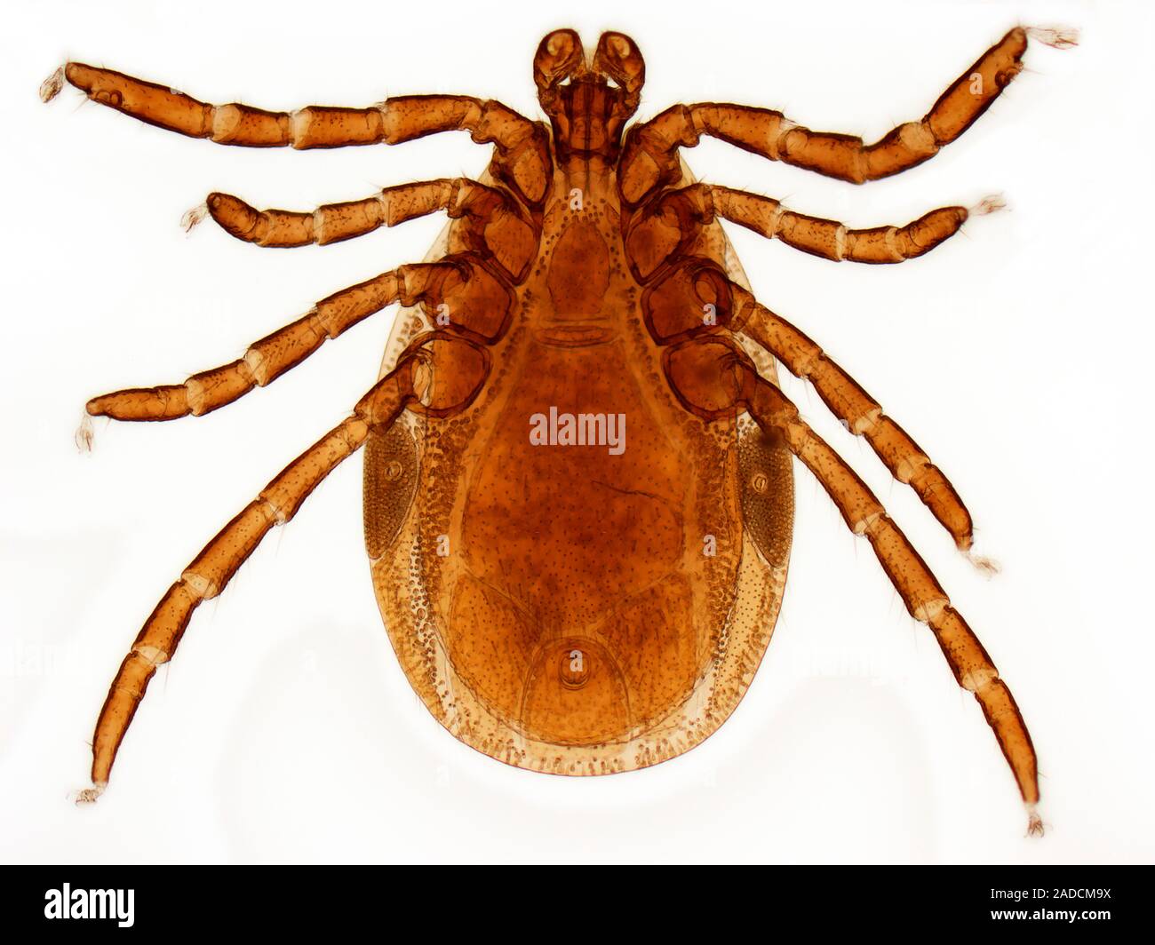 Light micrograph (LM) of a male Ixodes ricinus tick, the principal ...
