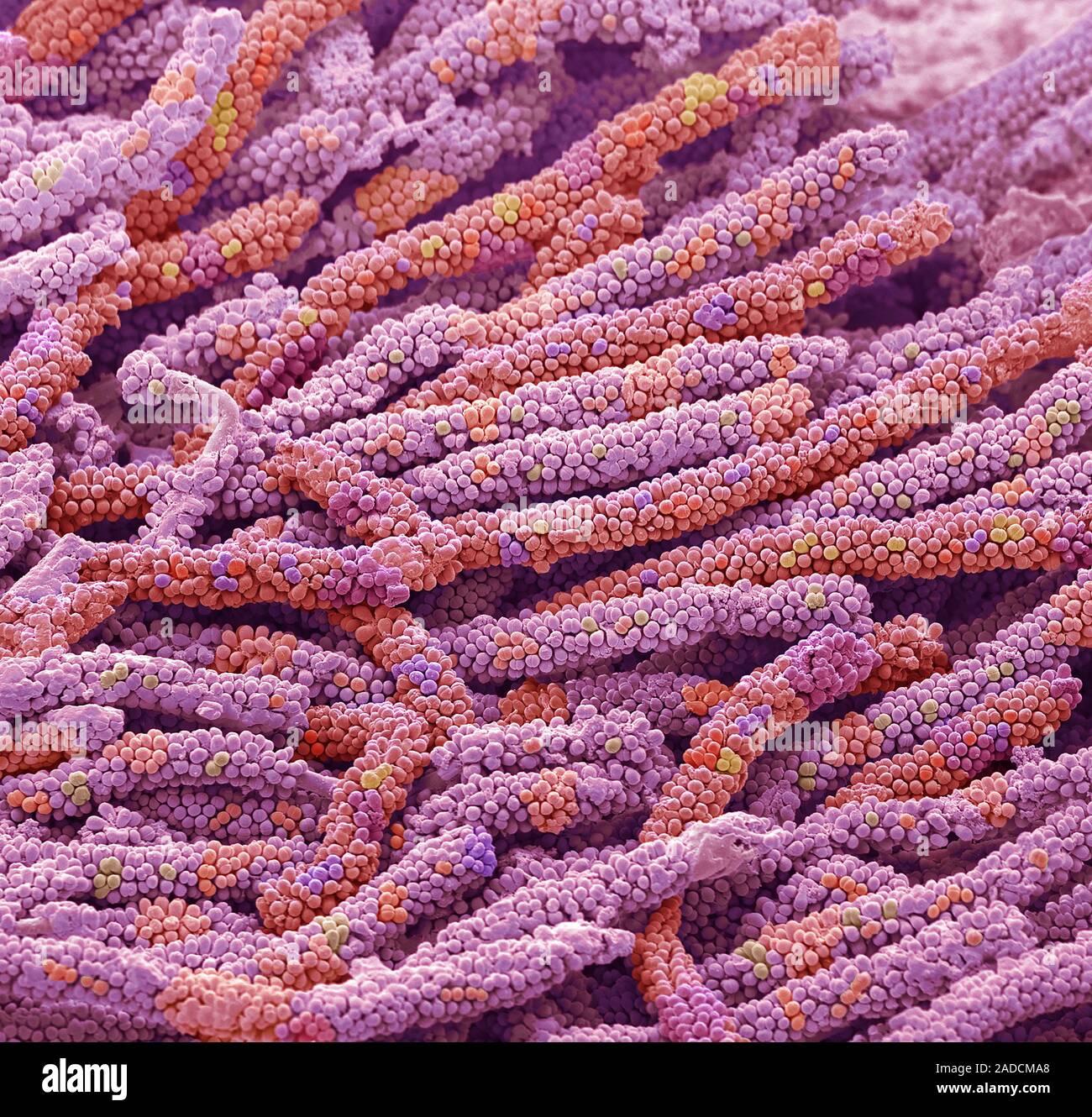 Tooth bacteria. Coloured scanning electron micrograph (SEM) of bacteria ...