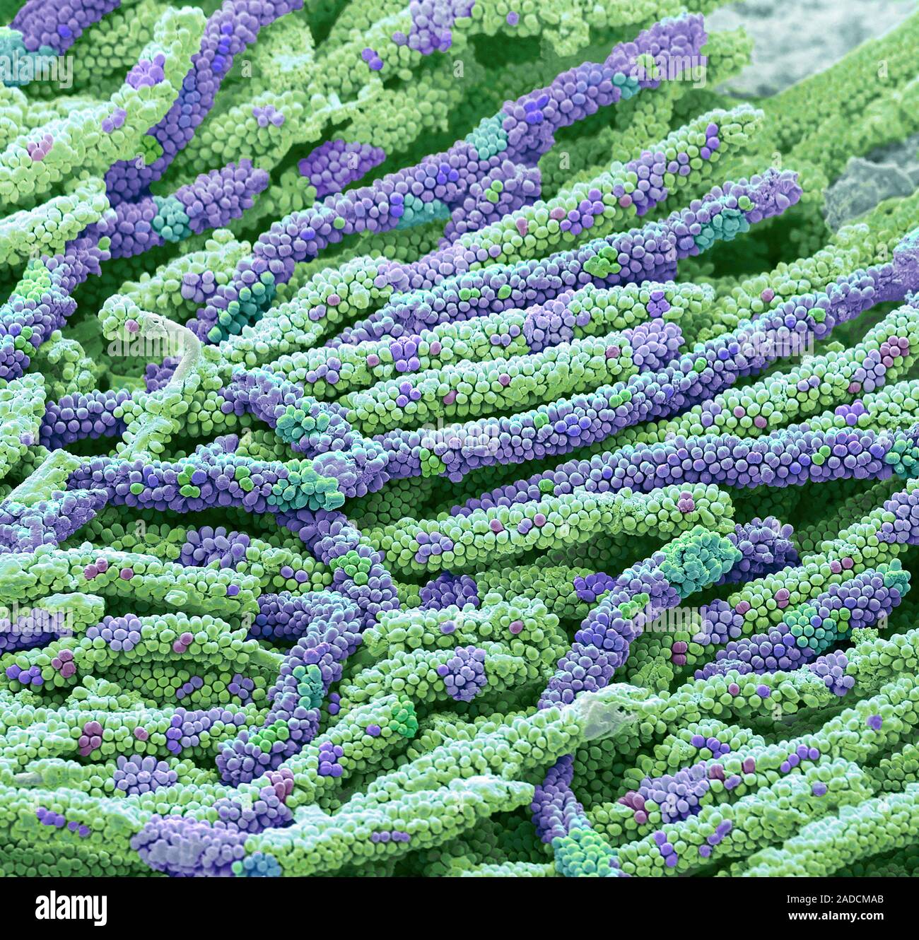 Tooth bacteria. Coloured scanning electron micrograph (SEM) of bacteria ...