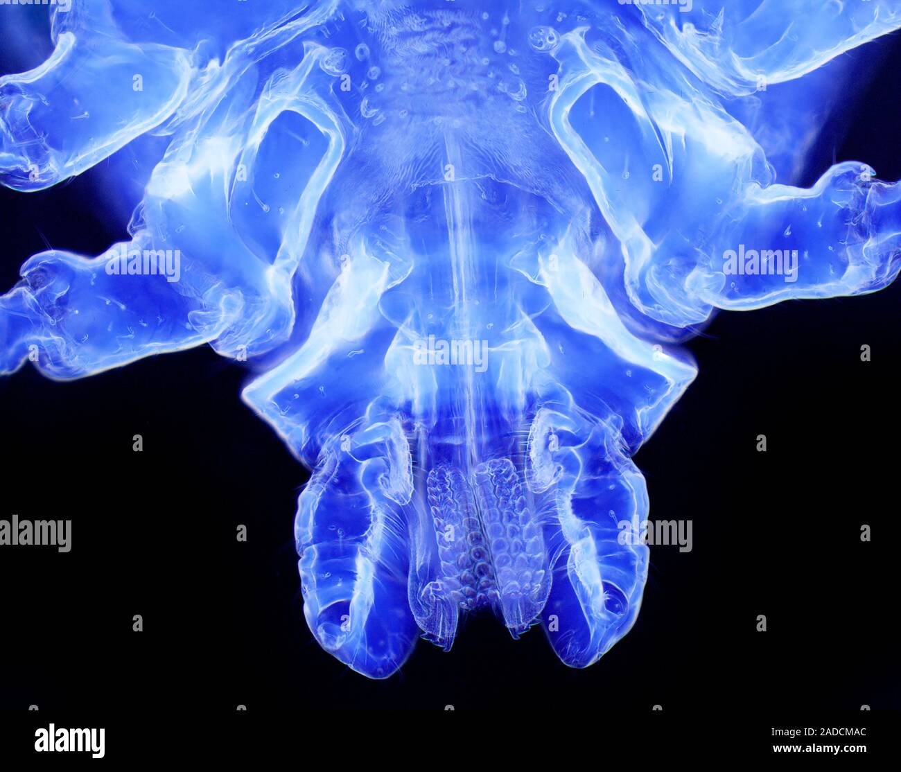 Light micrograph (LM) of the mouth parts of a brown dog tick ...