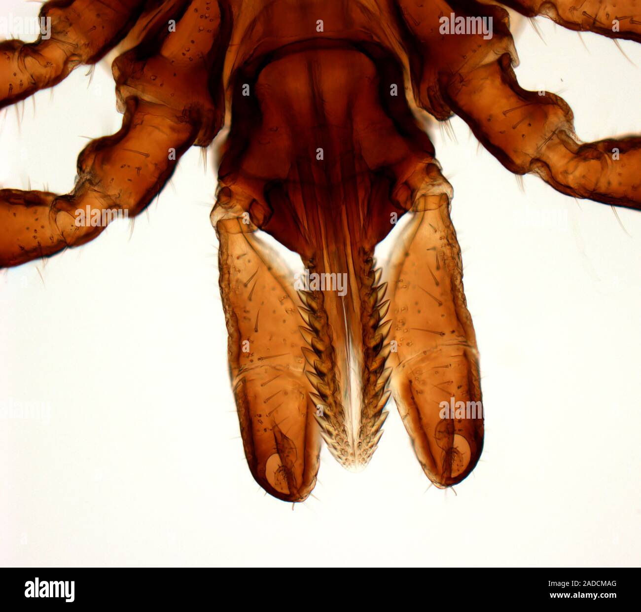 Lyme disease tick (Ixodes ricinus) mouthparts, light micrograph (LM ...
