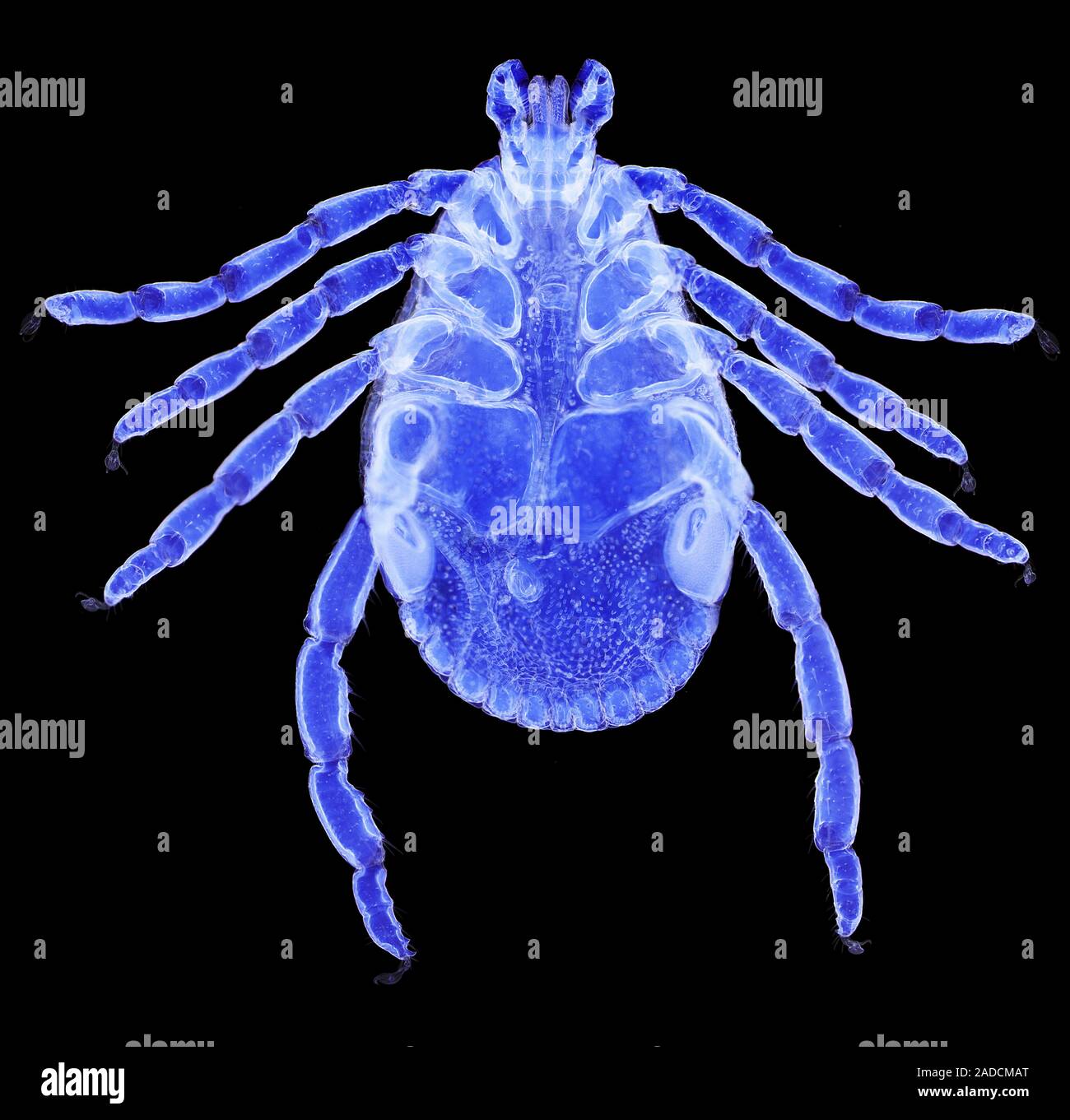 American dog tick (Dermacentor variabilis), light micrograph (LM) from ...