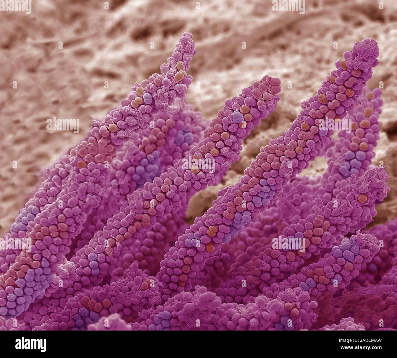 Tooth bacteria. Coloured scanning electron micrograph (SEM) of bacteria ...