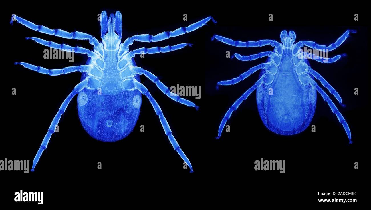 Male (right) and female (left) Lyme disease ticks (Ixodes ricinus ...