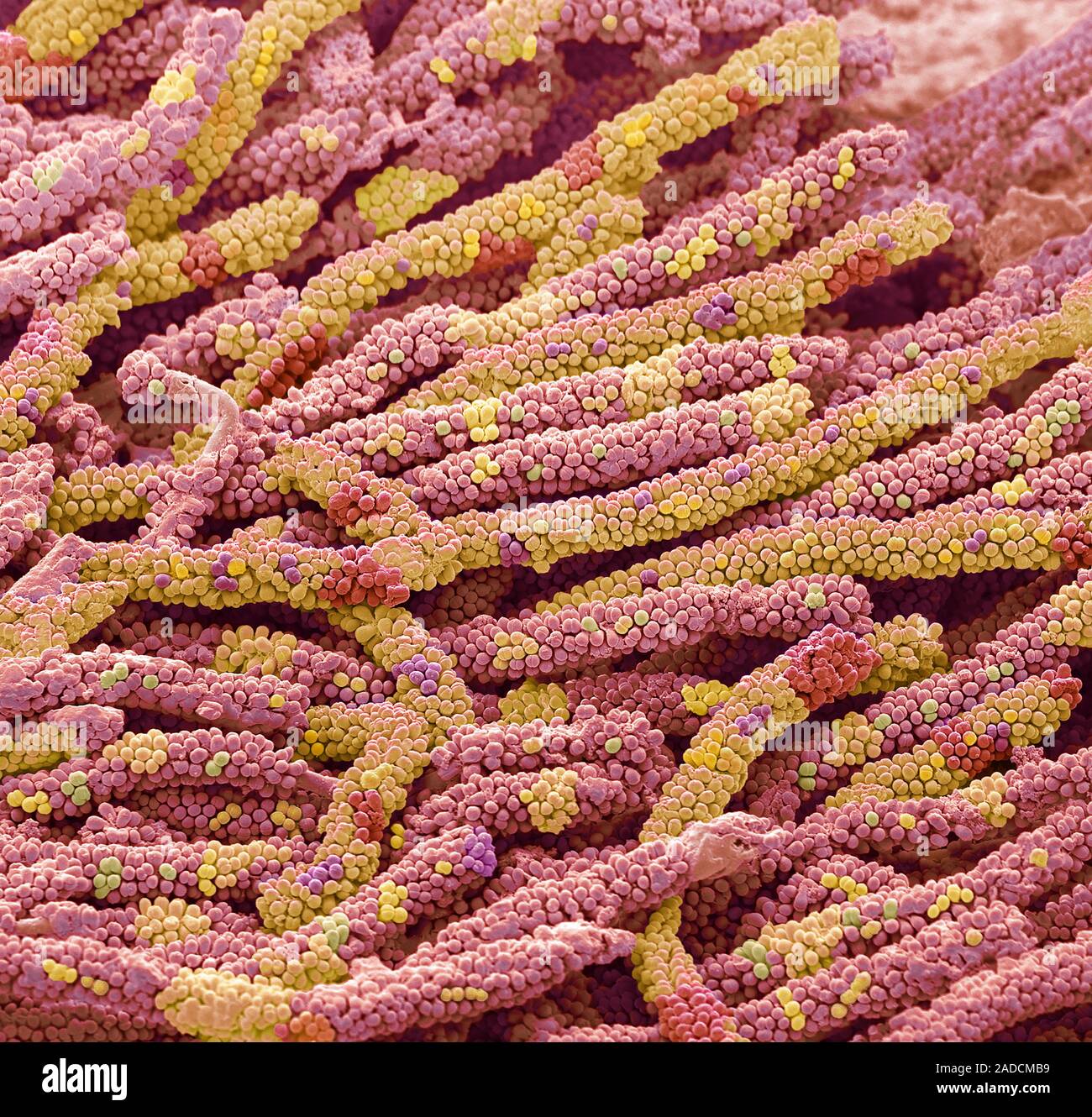 Tooth bacteria. Coloured scanning electron micrograph (SEM) of bacteria ...