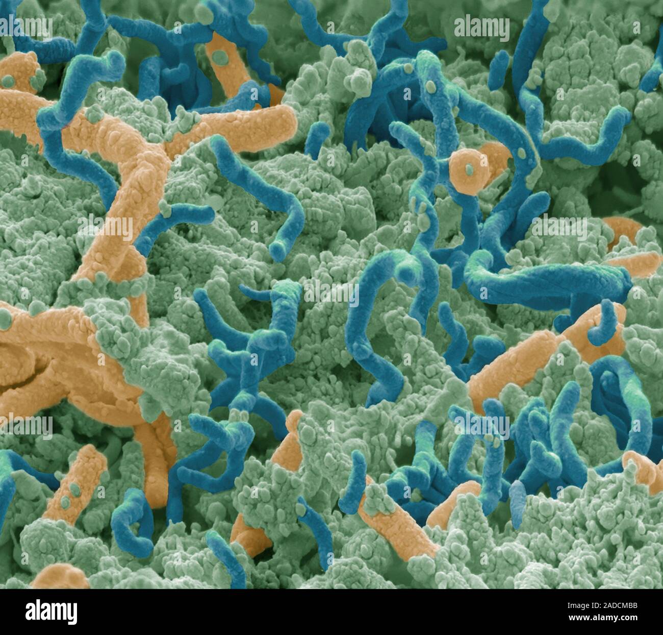 Tooth bacteria. Coloured scanning electron micrograph (SEM) of bacteria ...