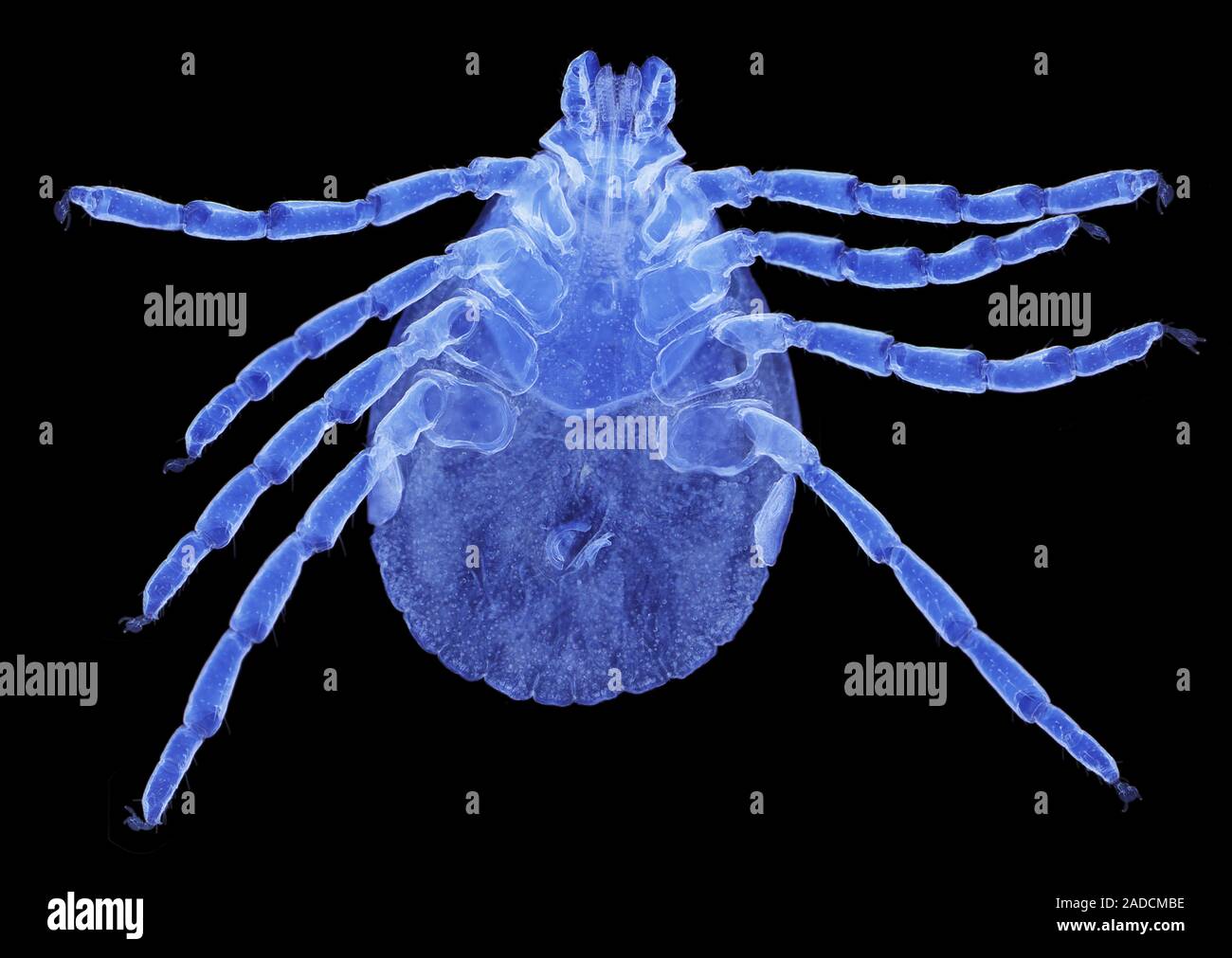 Light micrograph (LM) of a brown dog tick (Rhipicephalus sanguineus ...