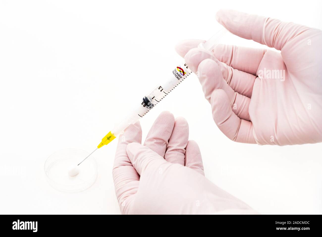 Collagen solution. Person holding a syringe containing fibrillar ...