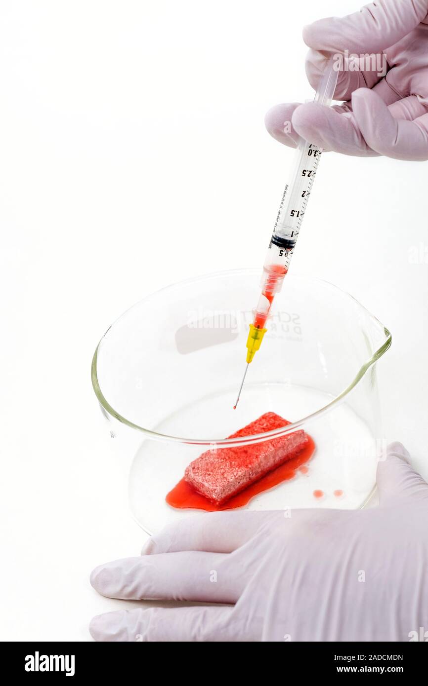 Collagen sponge. Person injecting a collagen sponge with a fluid (red ...