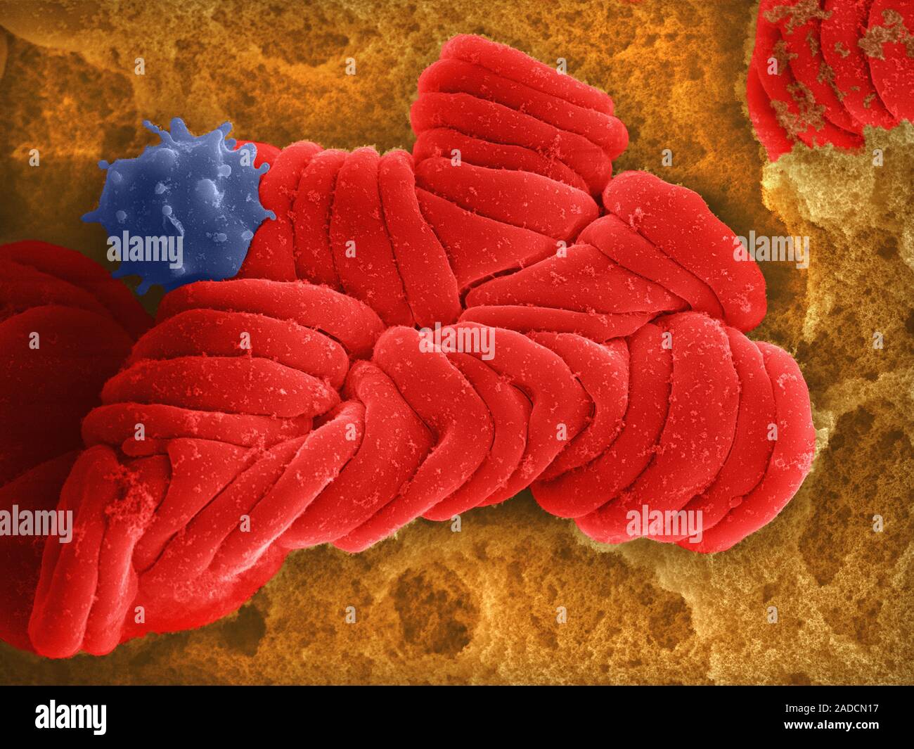 Blood clot. Coloured scanning electron micrograph (SEM) of red blood ...