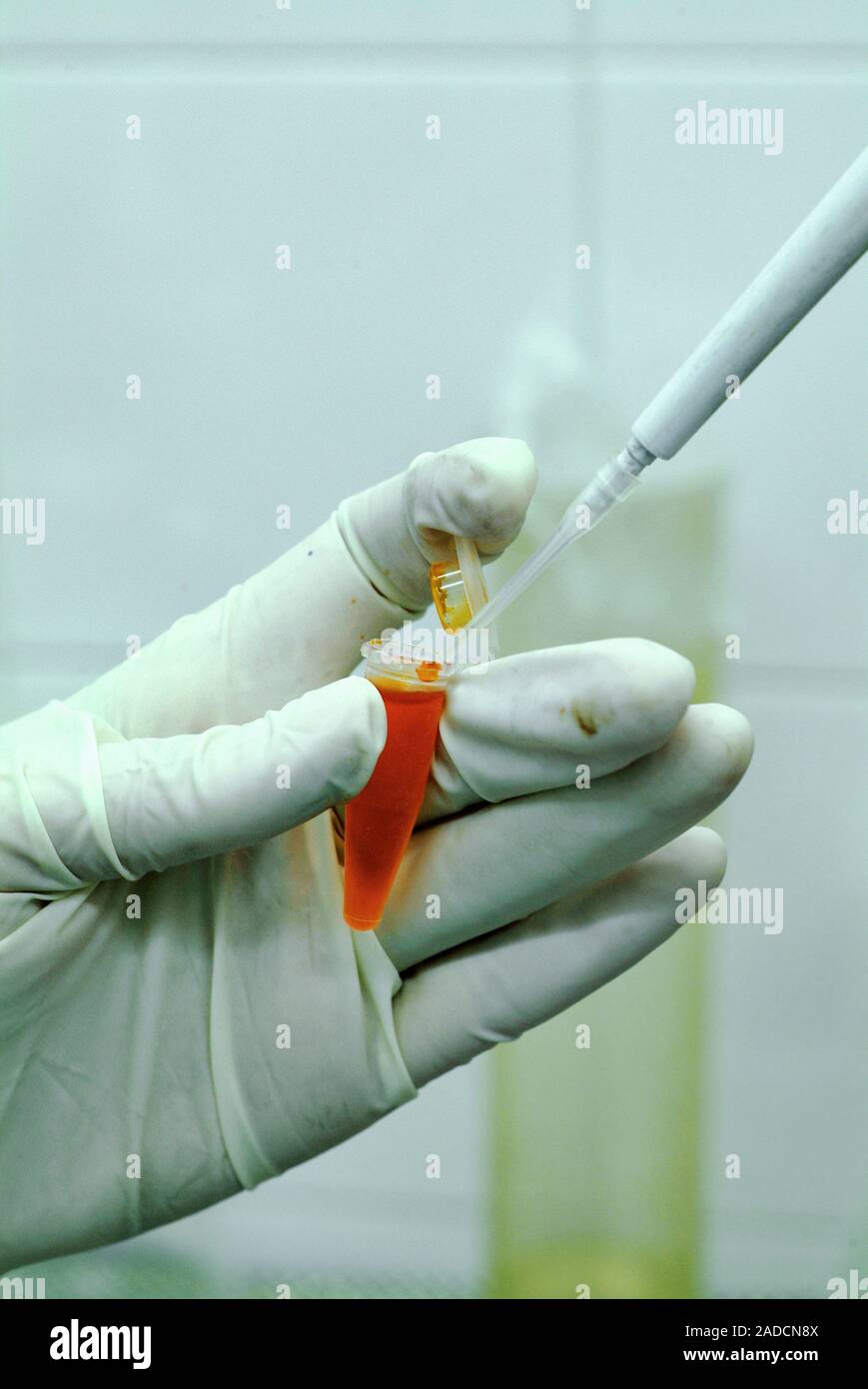 DNA test in anthropology laboratory. Close-up of a DNA ...