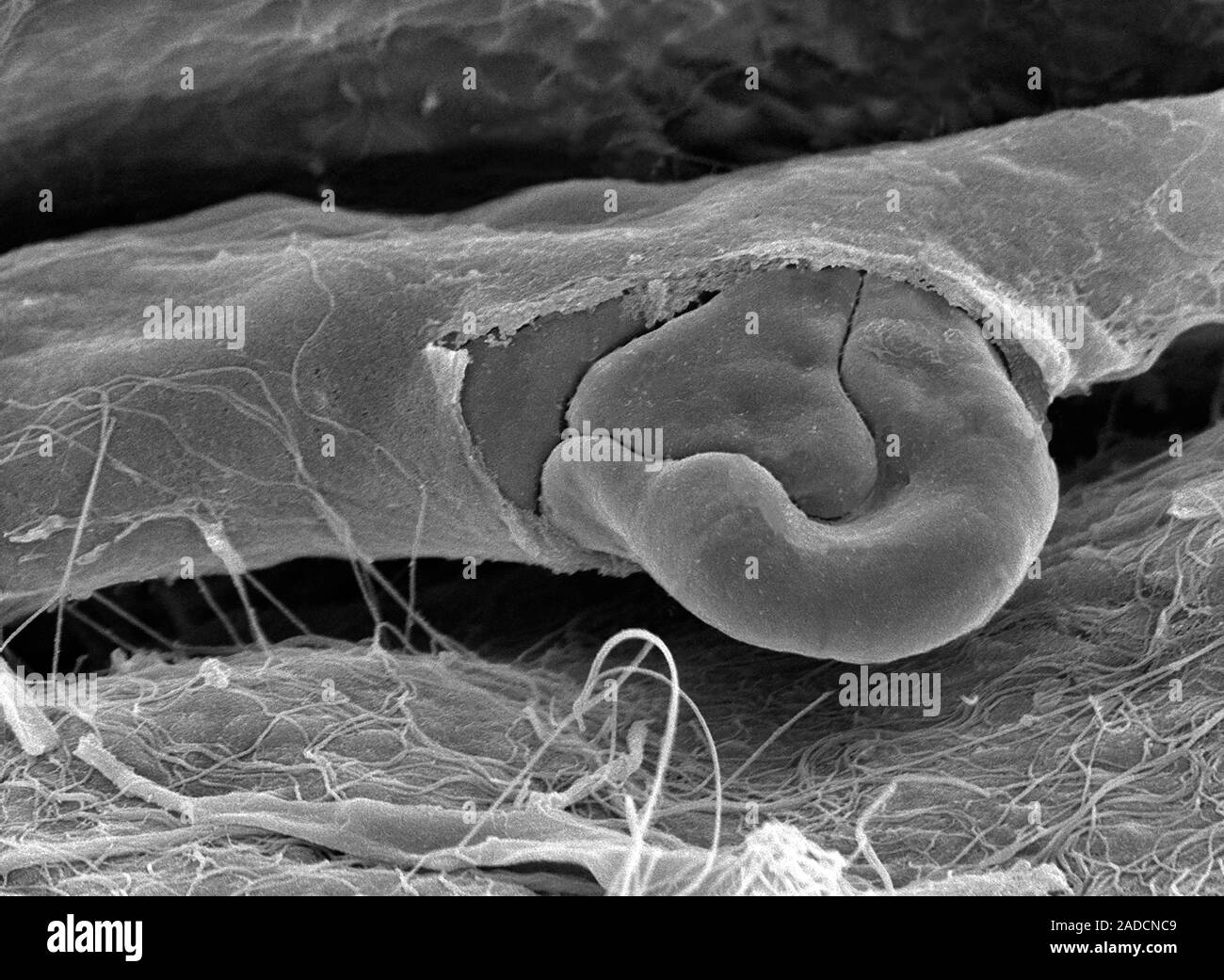 Ruptured capillary. Scanning electron micrograph (SEM) of a red blood ...