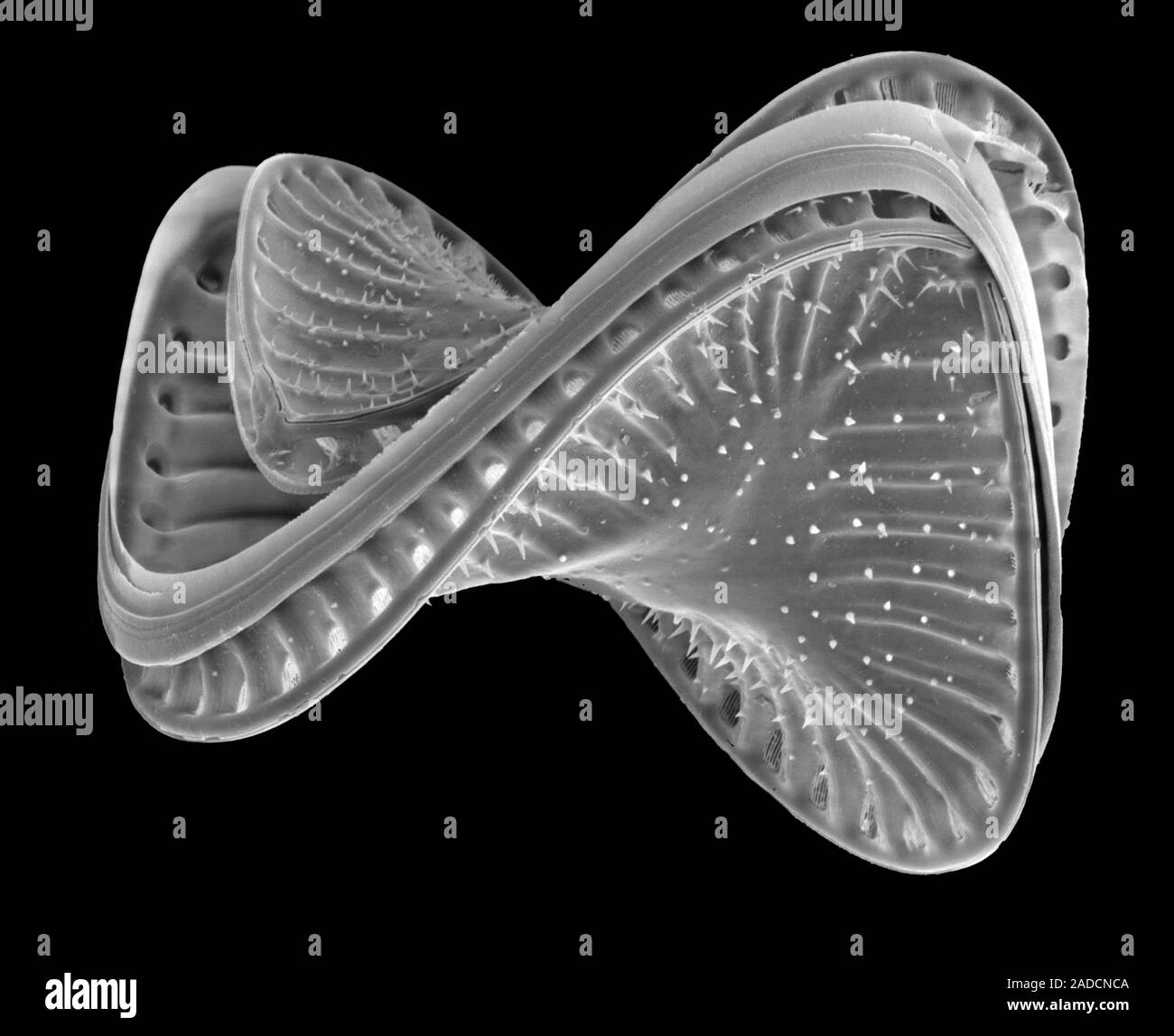 Diatom. Scanning electron micrograph (SEM) of a Campylodiscus sp ...