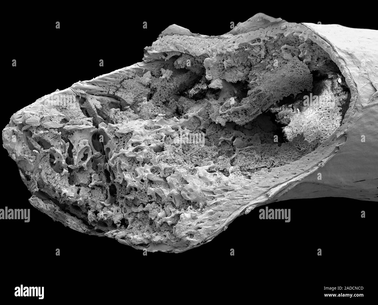 Interior of a bone. Scanning electron micrograph (SEM) of a long bone ...