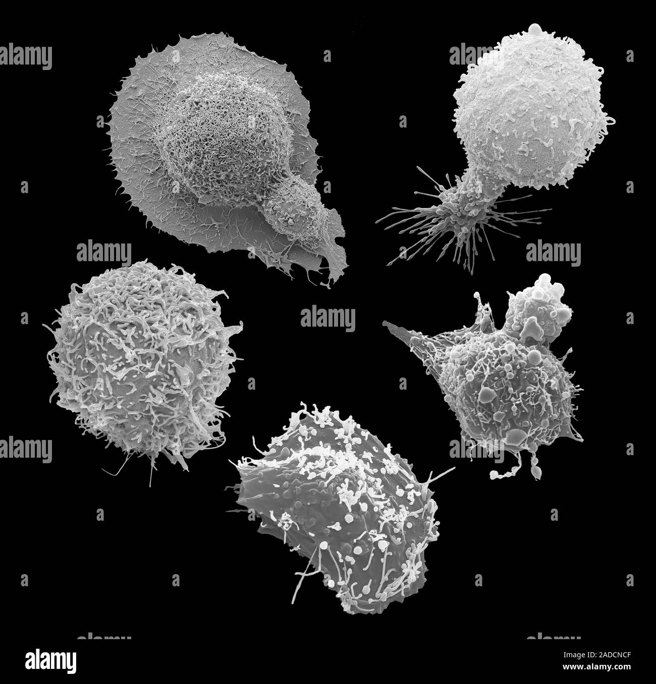 Male cancers. Scanning electron micrograph (SEM) of cells from the five ...